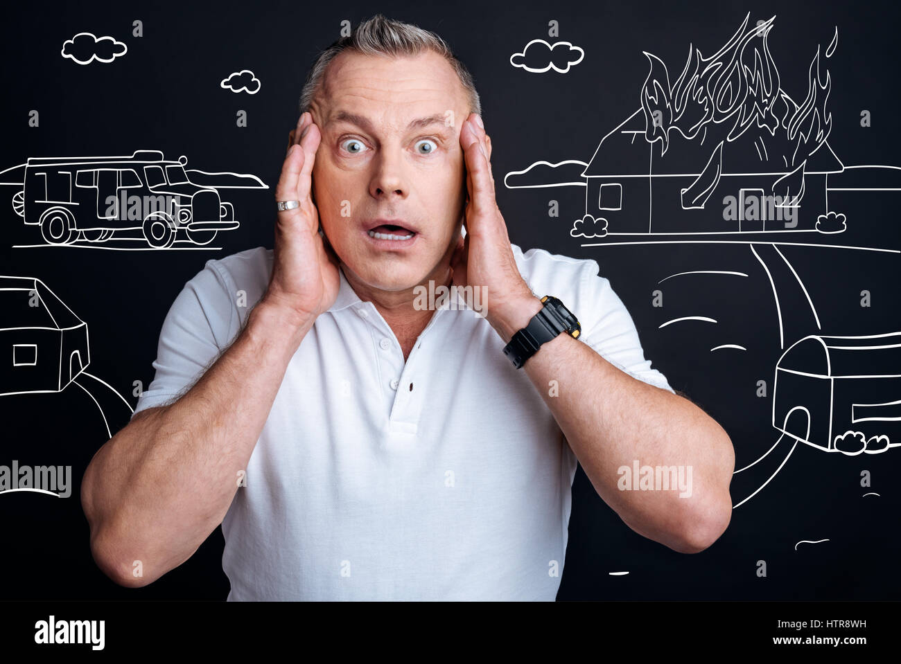 Fire accident face burn hi-res stock photography and images - Alamy