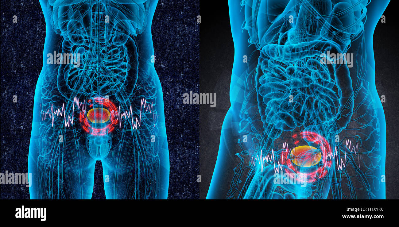 3D rendering medical illustration of the bladder pain Stock Photo - Alamy