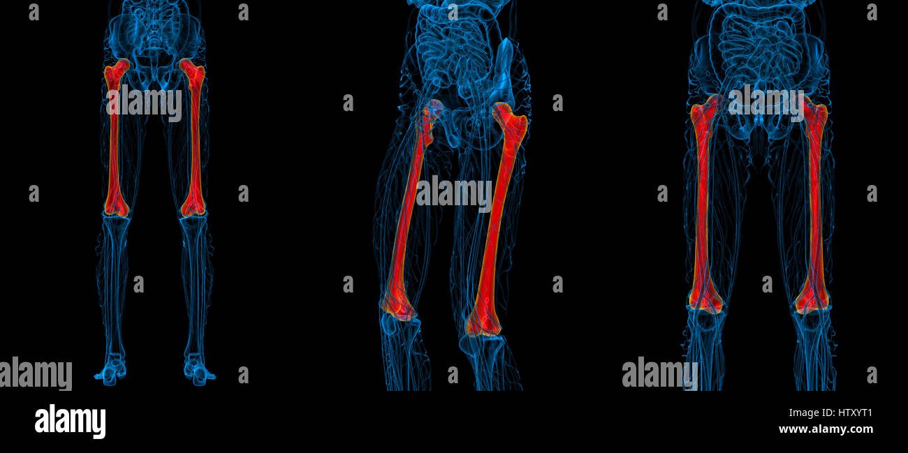 3d rendering medical illustration of the femur bone Stock Photo - Alamy
