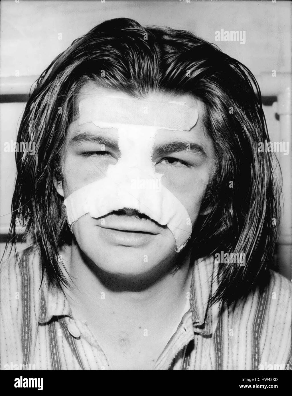 Feb. 02, 1965 - Screaming Lord Sutch Has A Nasal Operation At The ...