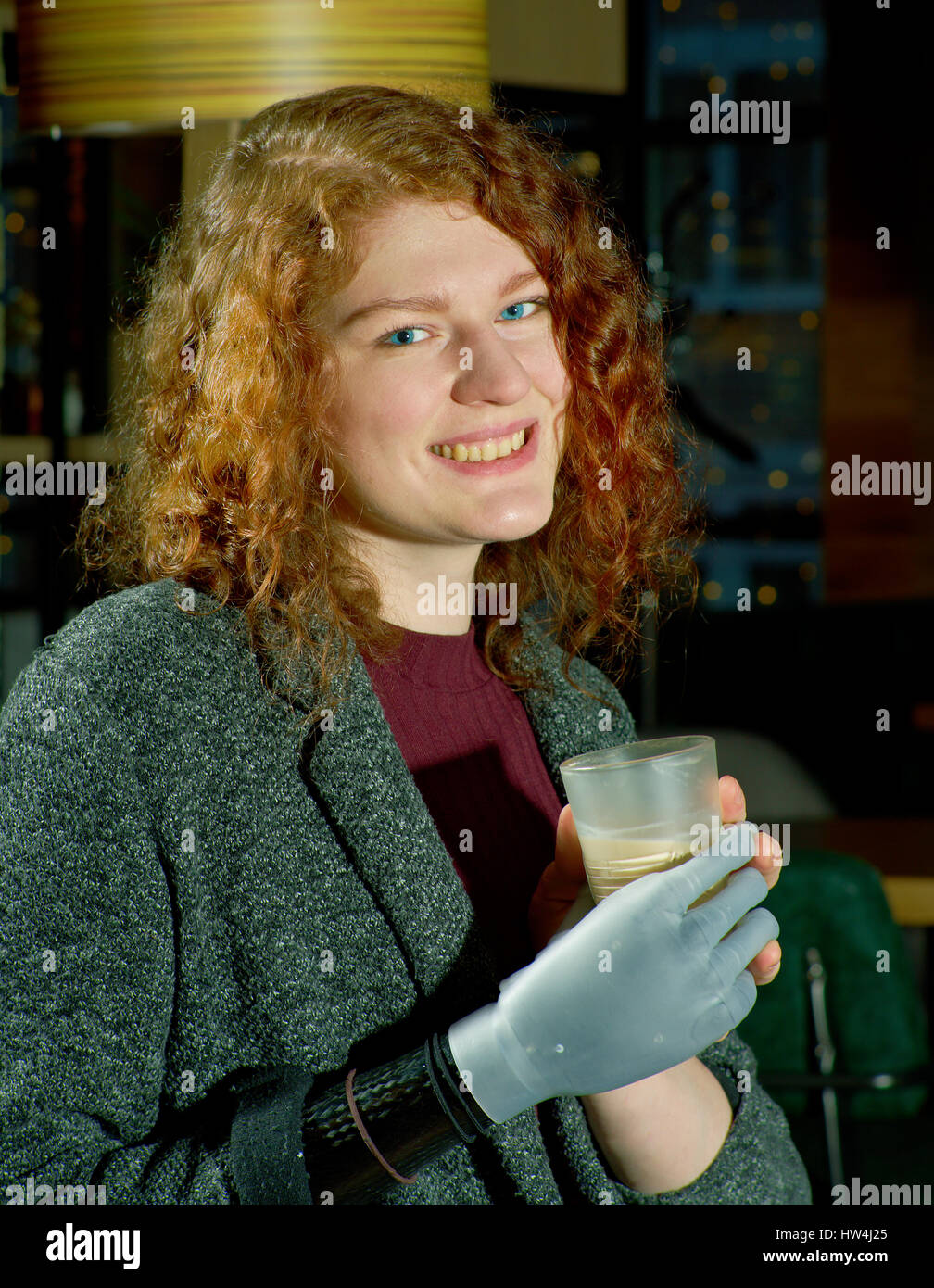 Prosthetic arm hi-res stock photography and images - Alamy