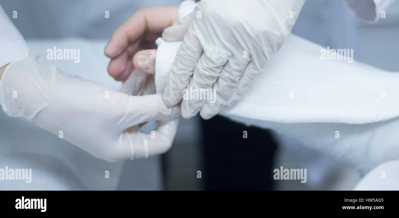 Doctor applying a plaster cast and bandages to patient forearm and ...