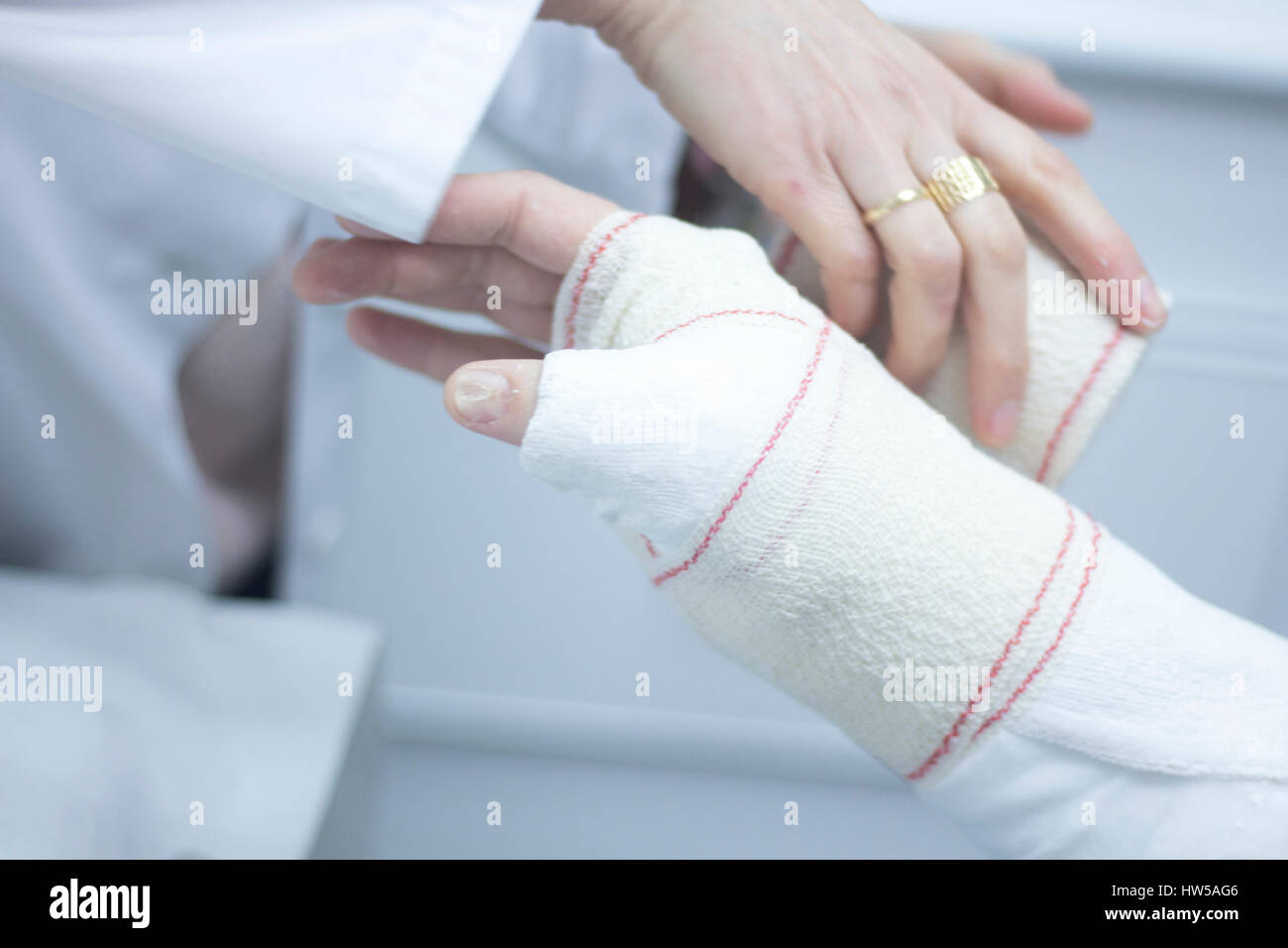 Doctor applying a plaster cast and bandages to patient forearm and ...