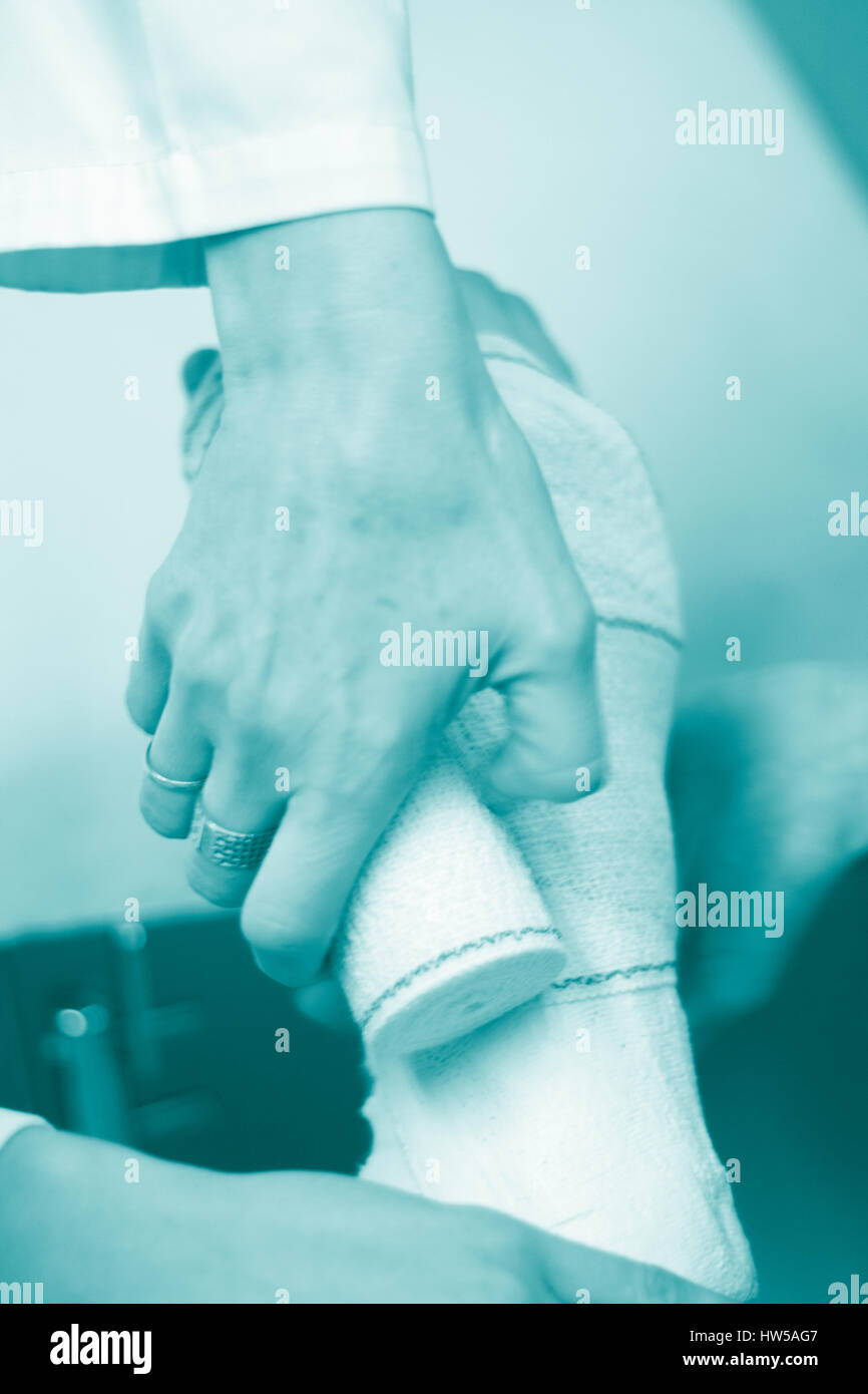 Plaster after wrist fracture hi-res stock photography and images - Alamy