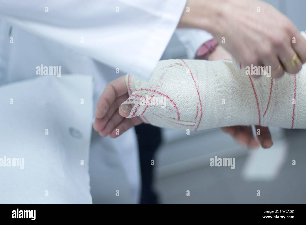 Doctor applying a plaster cast and bandages to patient forearm and ...