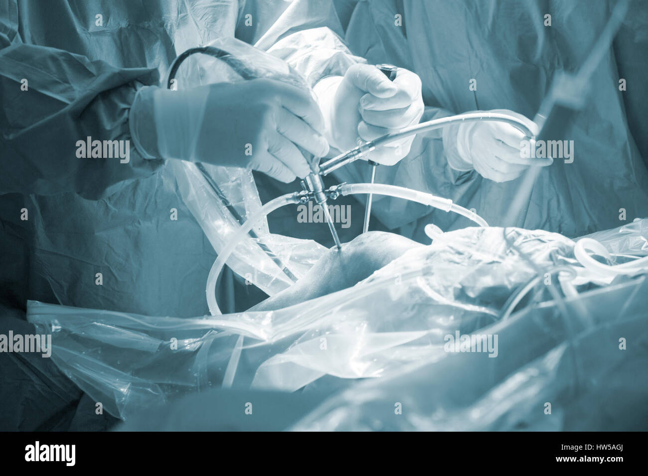 Knee keyhole surgery hospital arthroscopy operation medical procedure ...