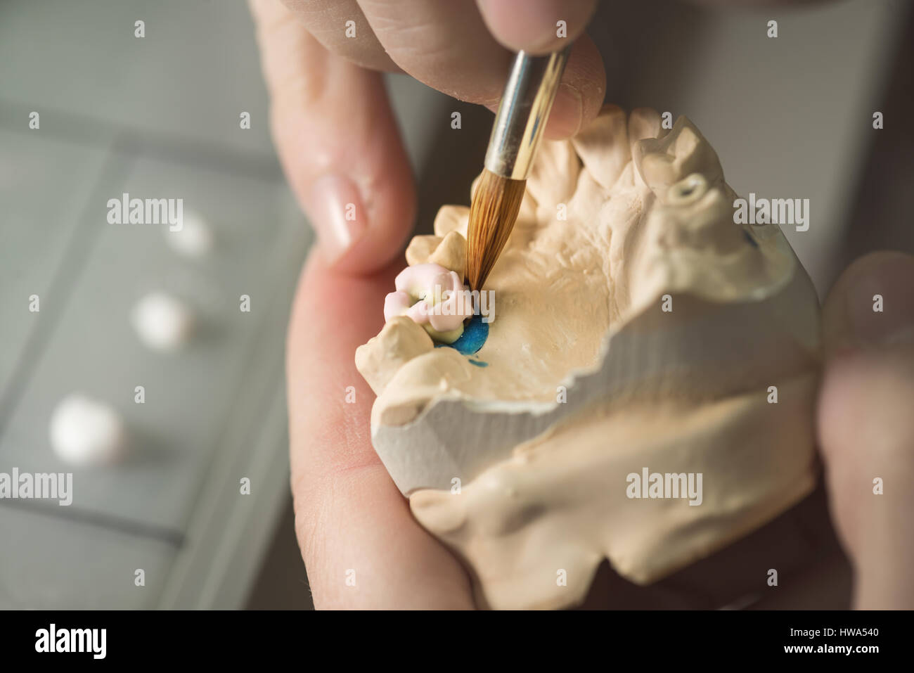 Dental prosthesis, artificial tooth, prosthetic, hands working on the ...