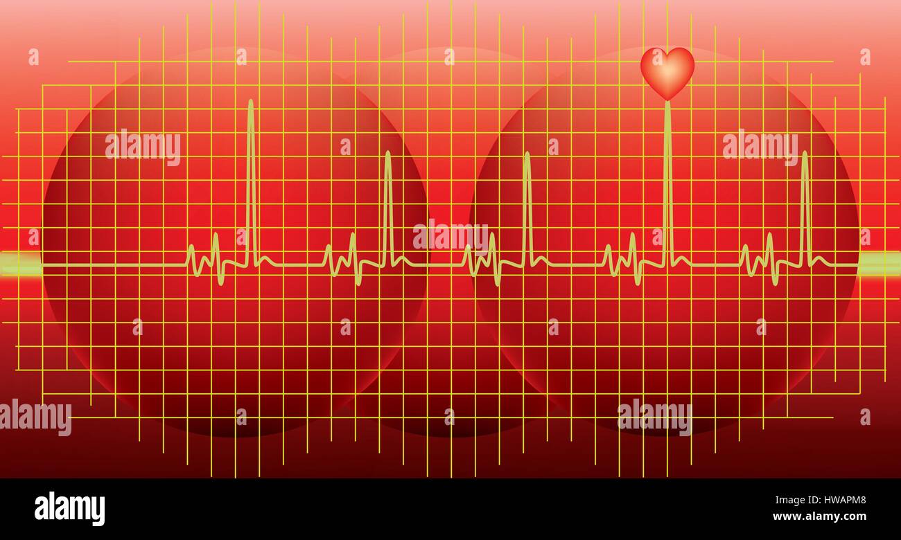 Electrocardiogram waves Stock Vector Images - Alamy