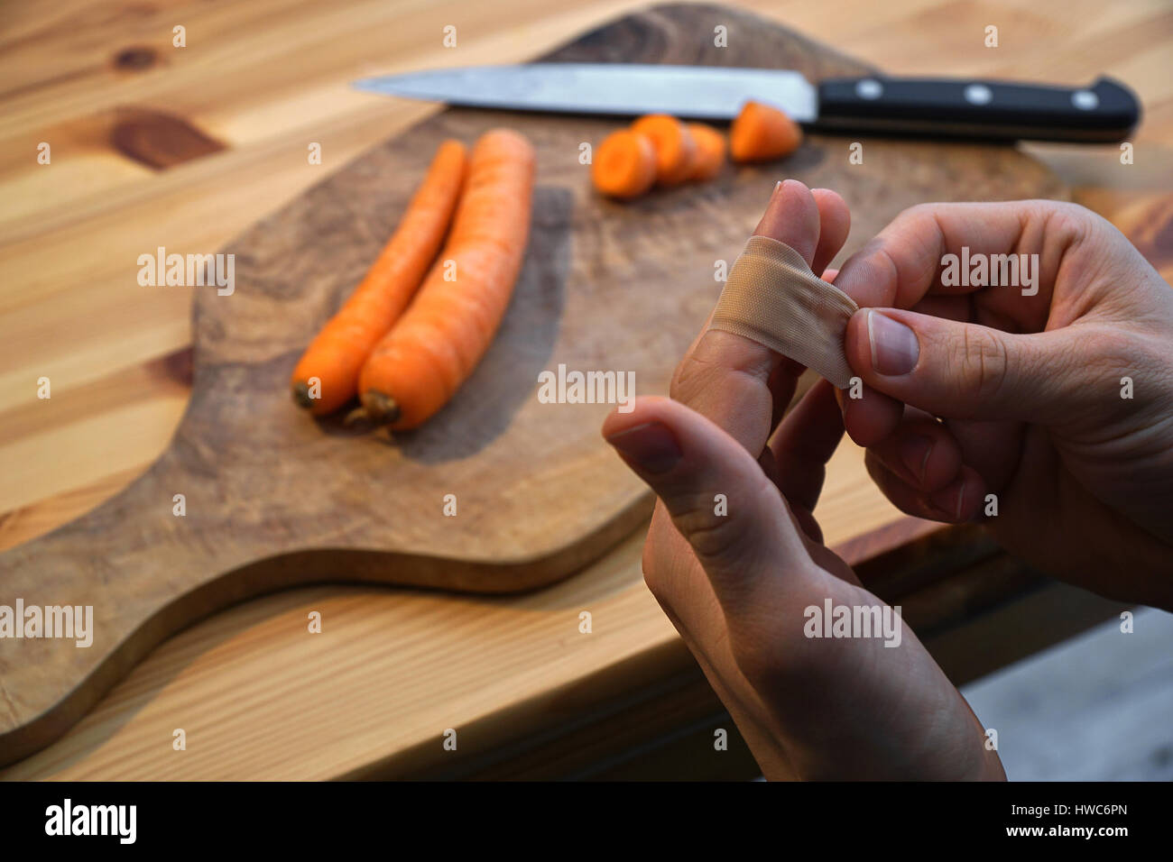 injured in the kitchen while cooking Stock Photo - Alamy