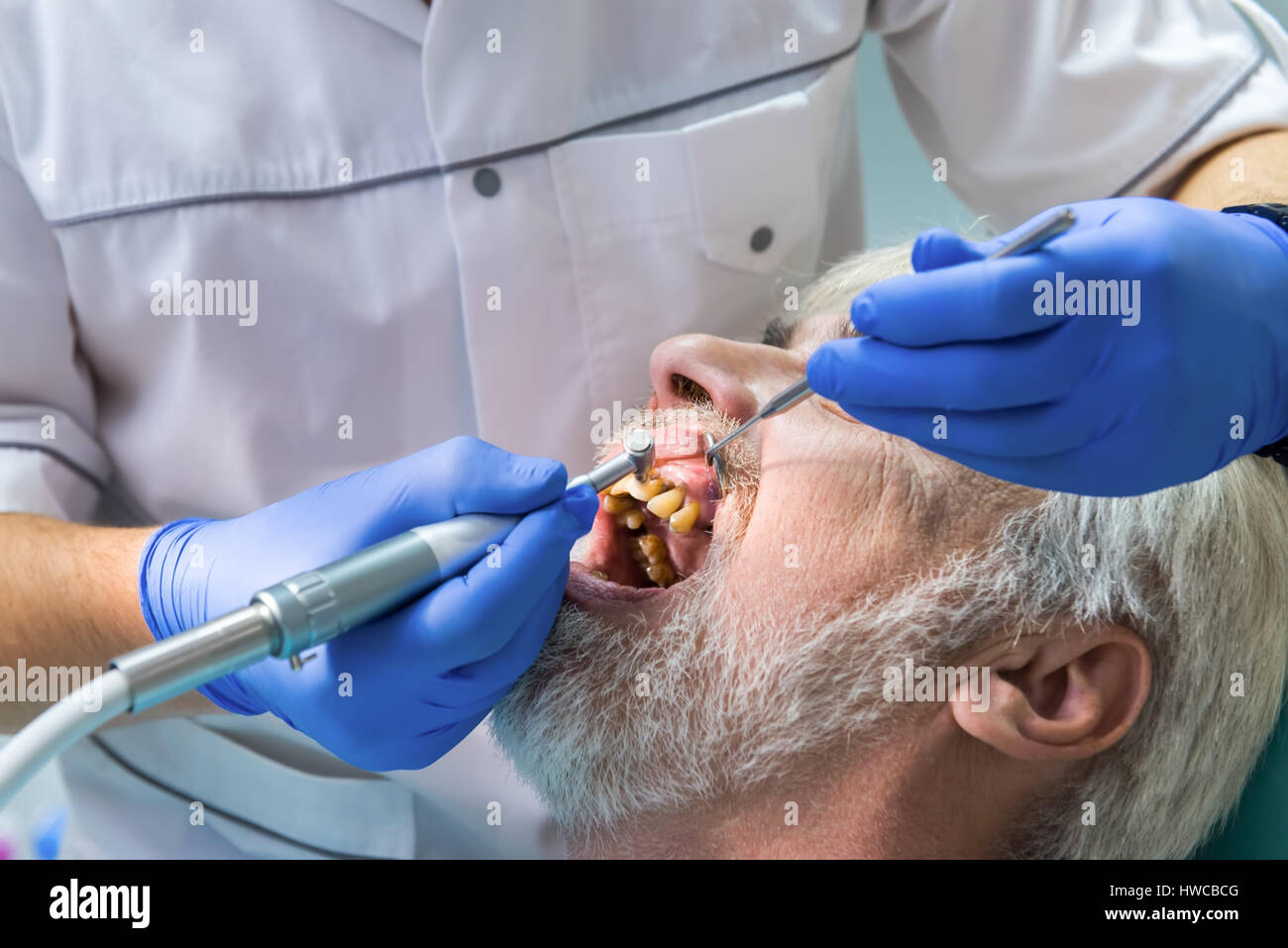 Yellow teeth hi-res stock photography and images - Alamy