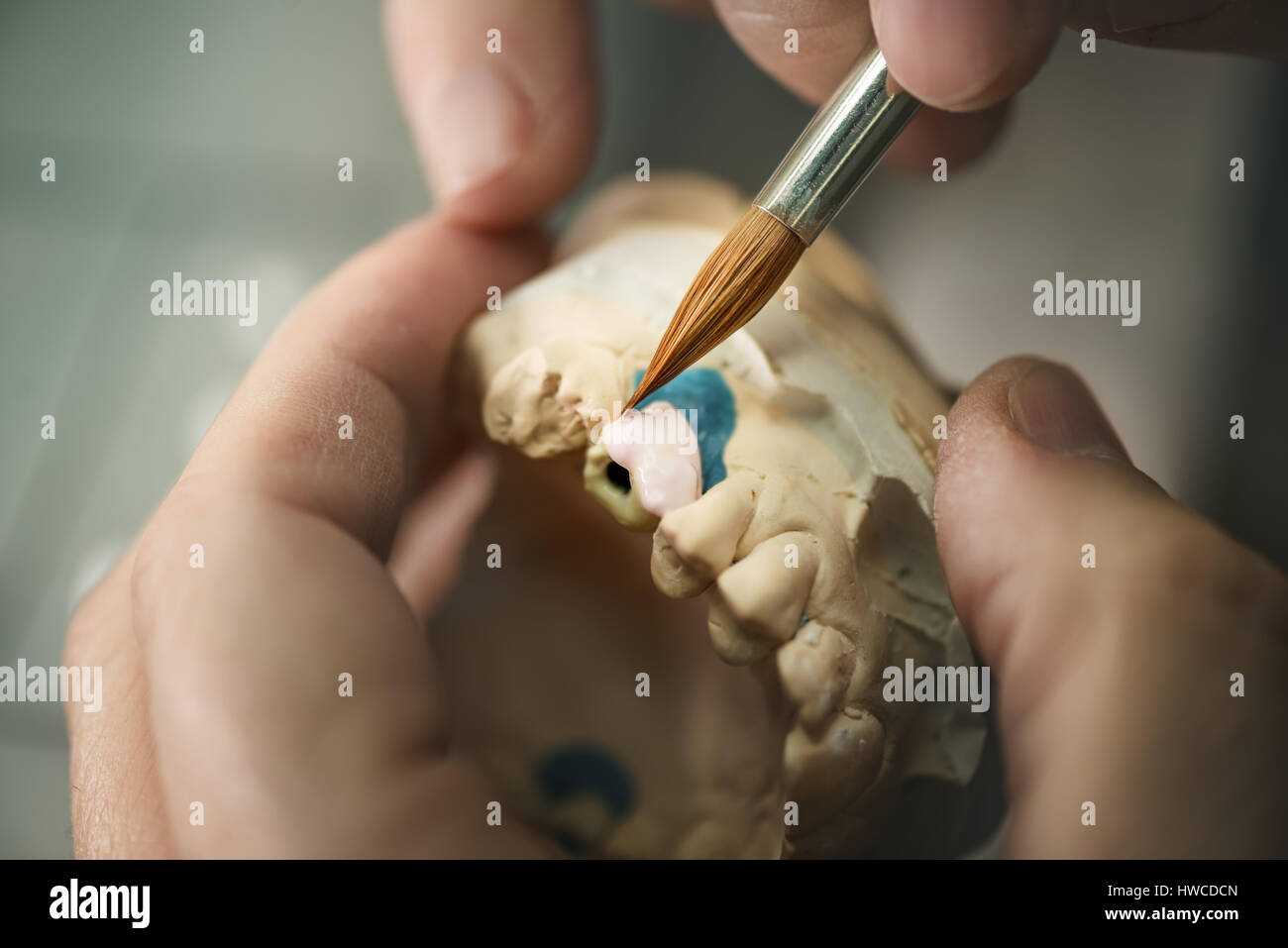 Dental prosthesis, artificial tooth, prosthetic, hands working on the ...