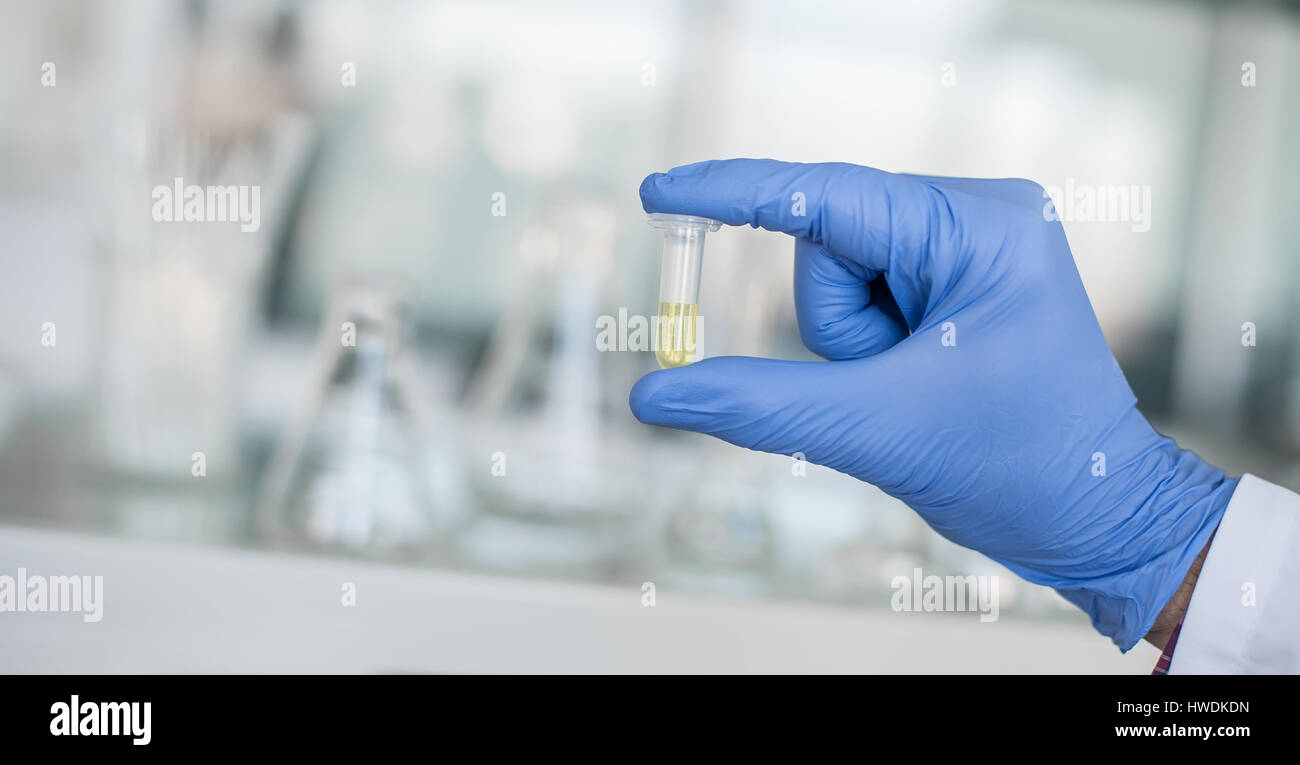 Lab technician holding a test tube with sample in the medical or ...