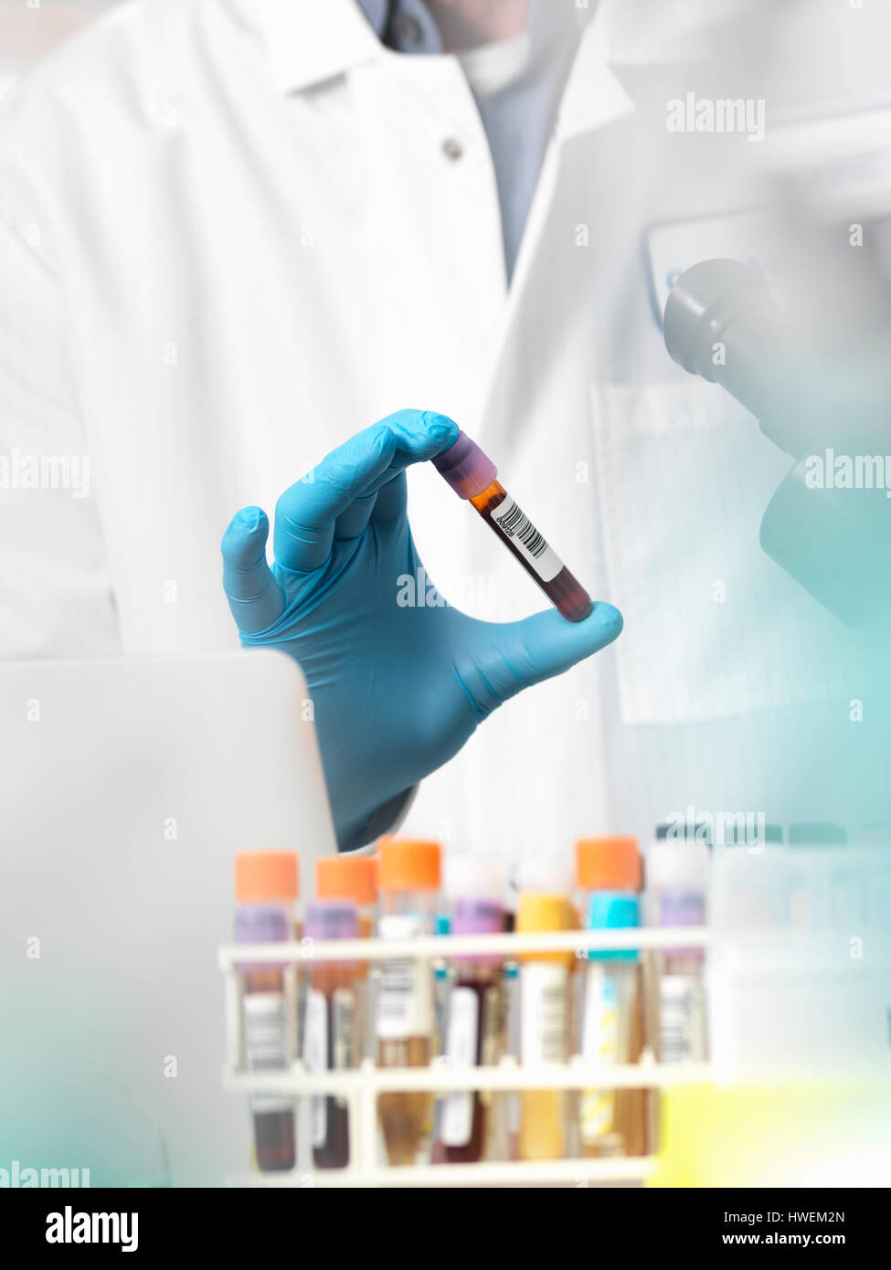 Scientist checking blood sample information ready for clinical testing ...