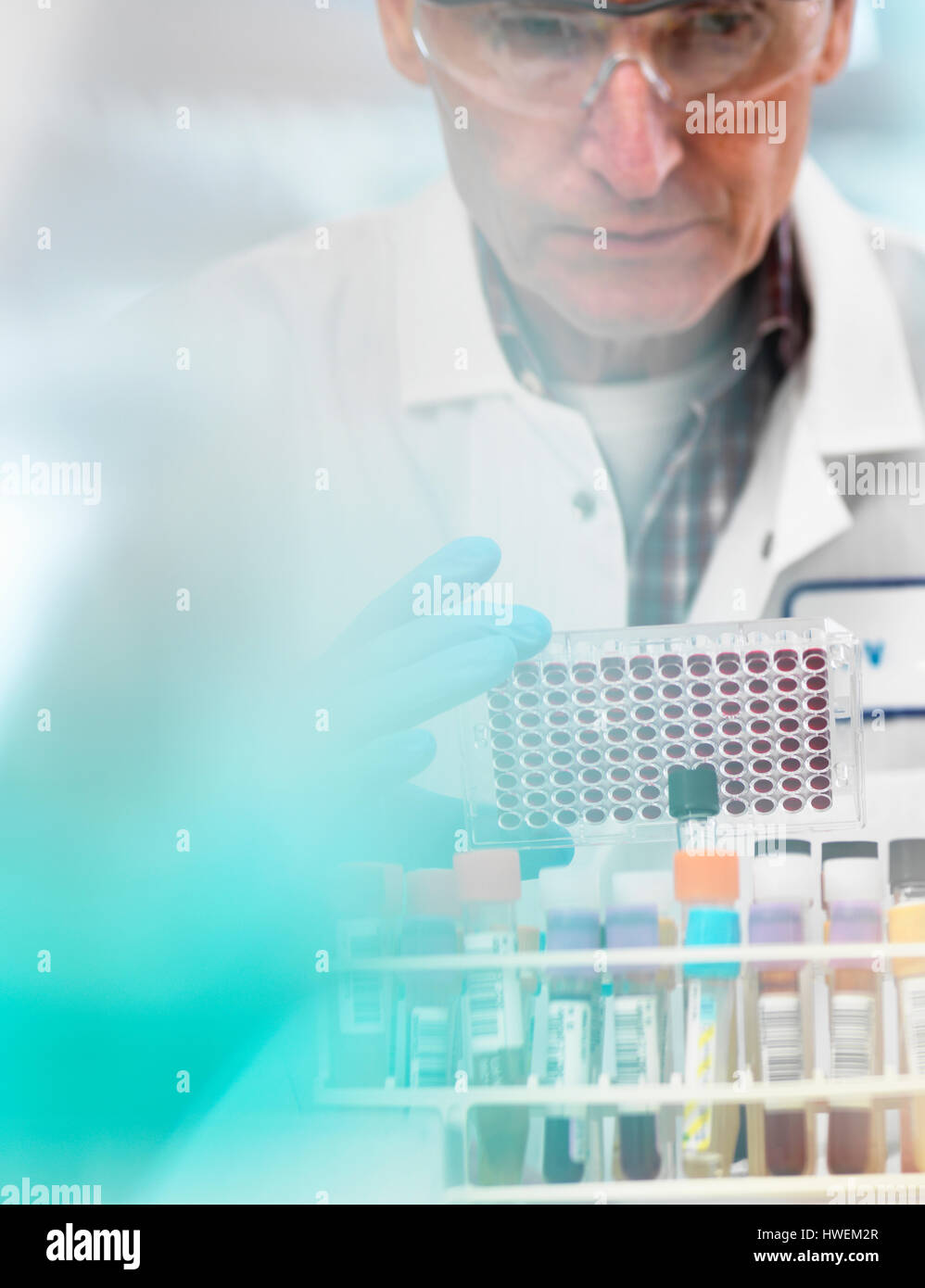 Scientist preparing blood samples in a multi well plate for clinical ...