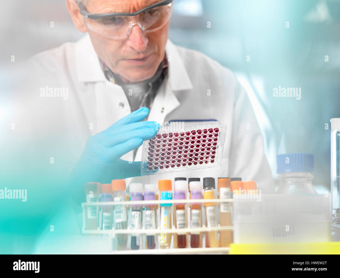 Scientist preparing blood samples in a multi well plate for clinical ...