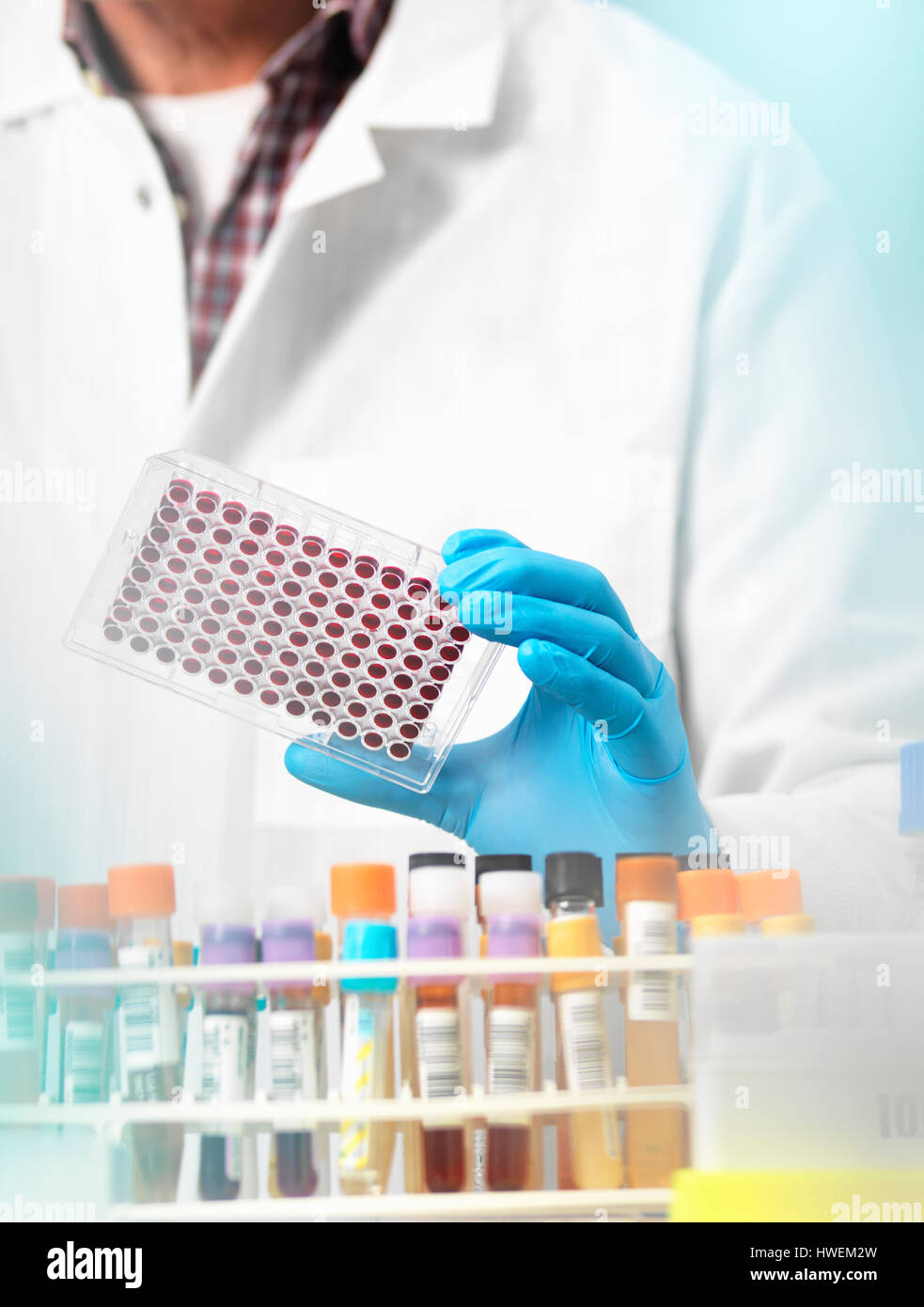 Scientist preparing blood samples in a multi well plate for clinical ...