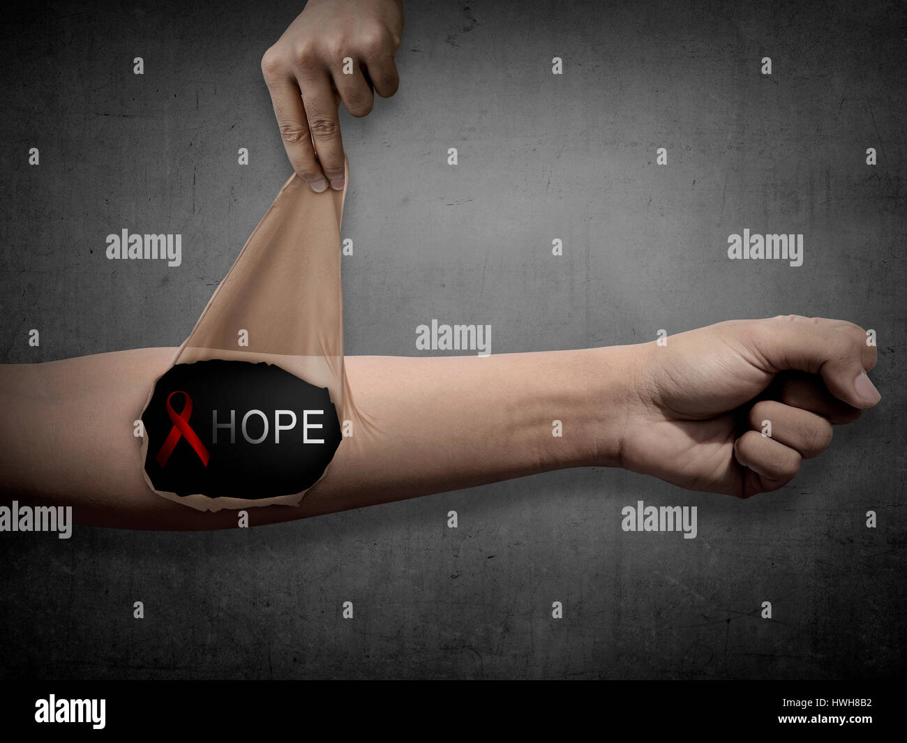 Hand open skin show red ribbon. Aids awareness concept Stock Photo - Alamy