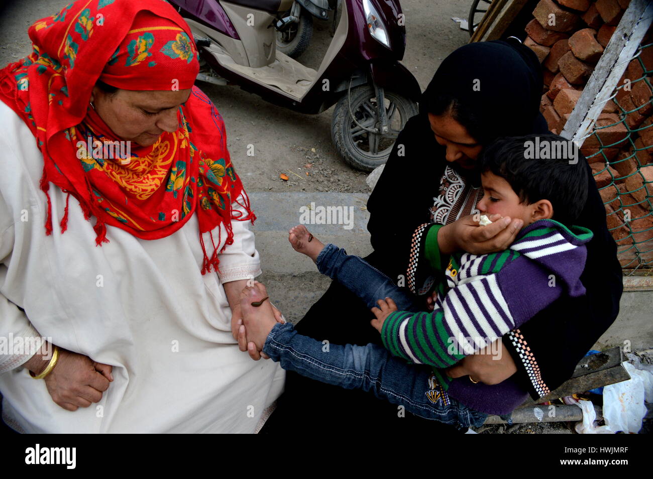 Srinagar, India. 21st Mar, 2017. Leech suck blood from a foot of a ...