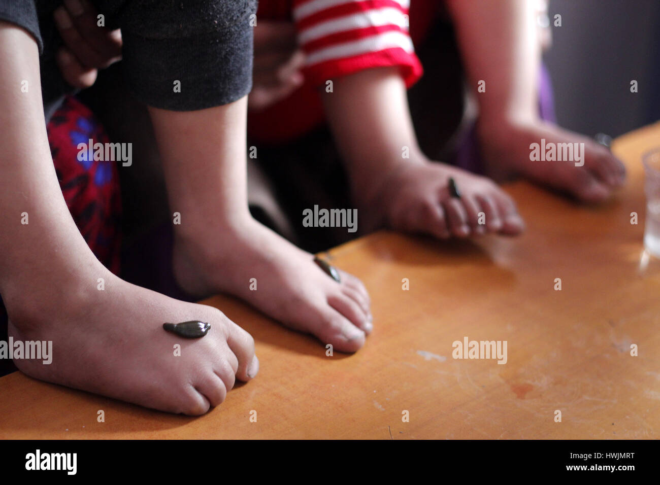 Leeches feet hi-res stock photography and images - Alamy