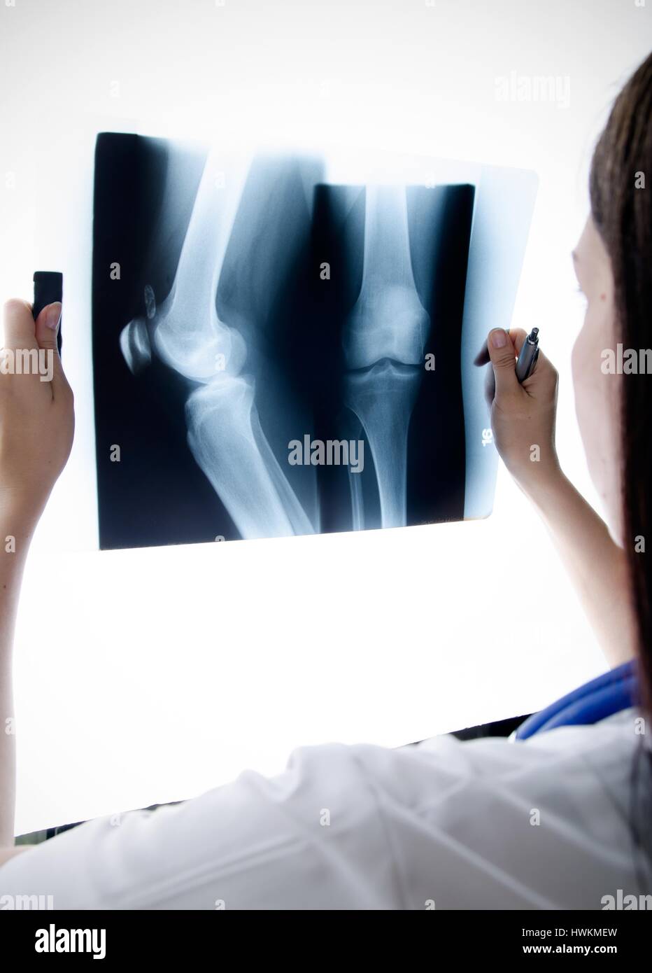 Doctor student x ray hi-res stock photography and images - Alamy