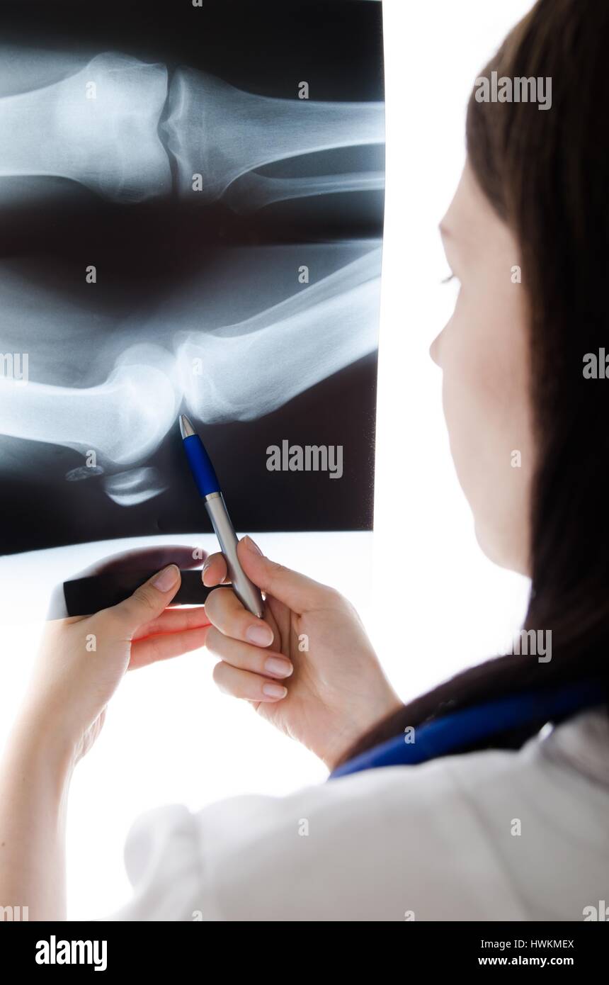 X ray of knee hi-res stock photography and images - Alamy