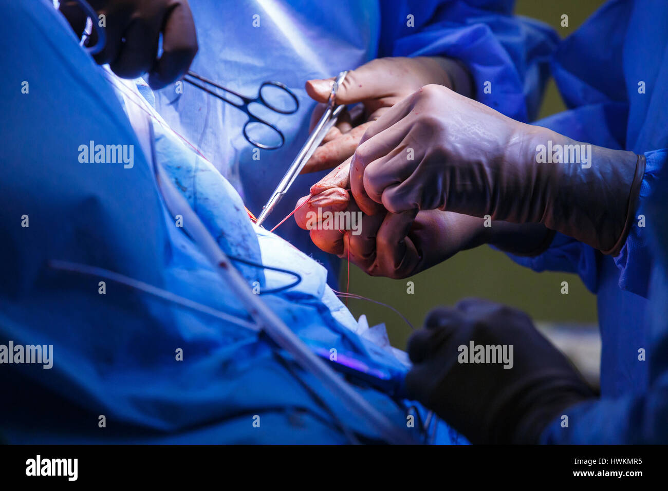 Real wound stitching human hi-res stock photography and images - Alamy