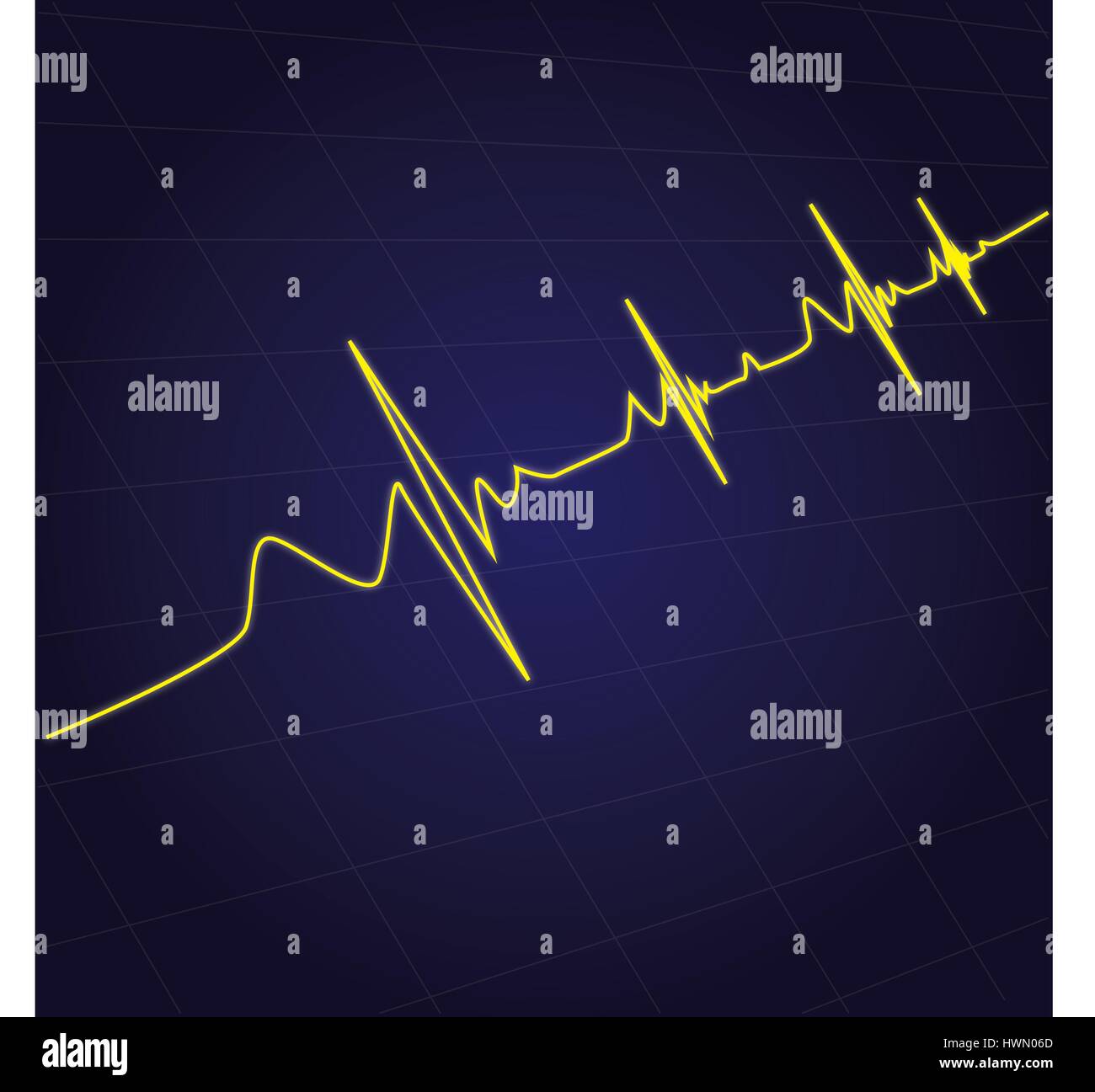 Human heart beat trace monitor hi-res stock photography and images - Alamy