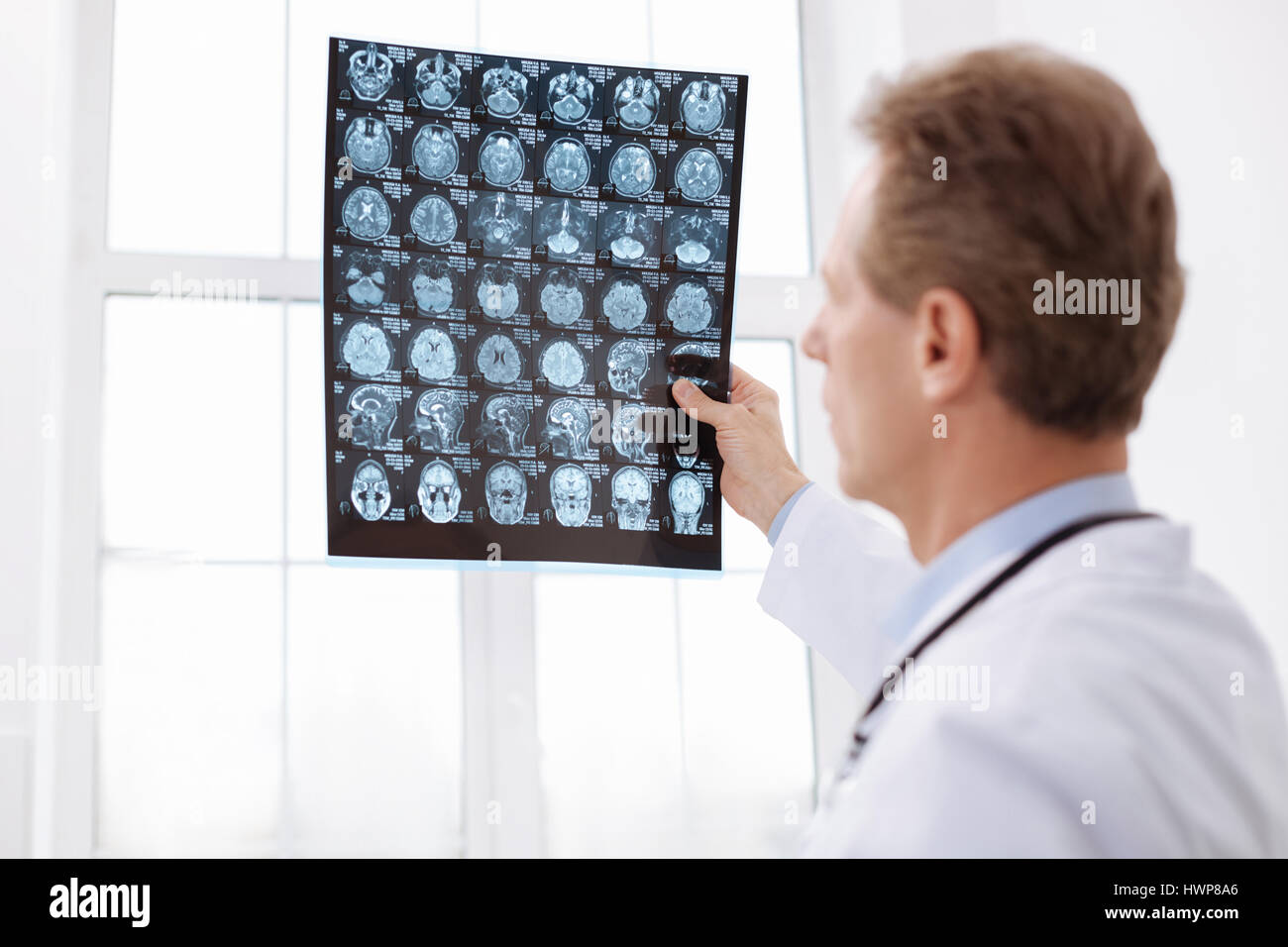 Brain mri scans hi-res stock photography and images - Alamy