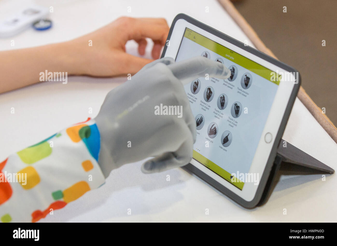 Ostrava, Czech Republic. 22nd Mar, 2017. Presentation of Bionic hand ...