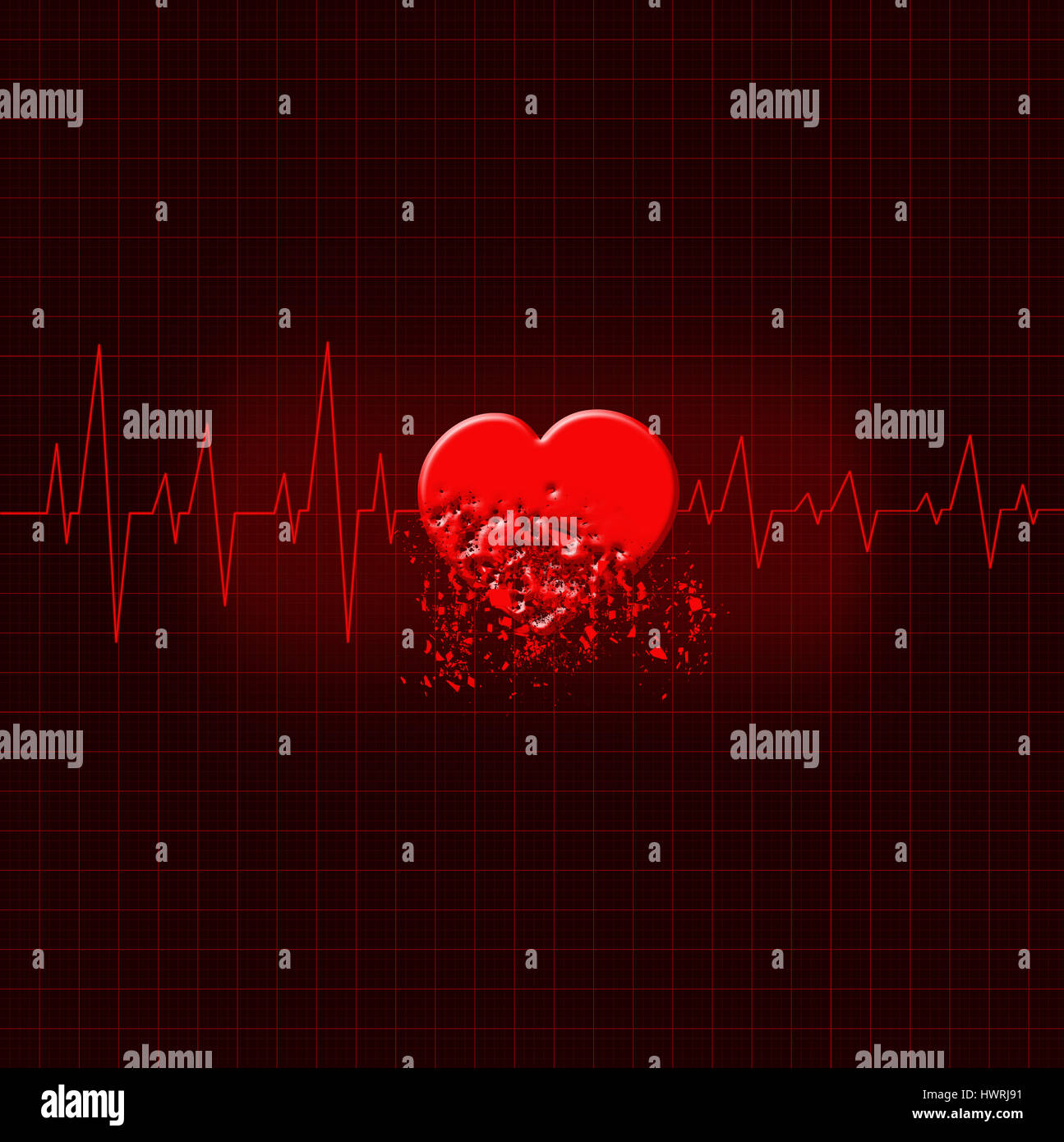 Electrocardiogram showing a heart attack then continues to beat Stock ...
