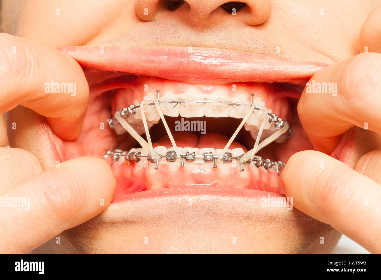 Wearing rubber rings hi-res stock photography and images - Alamy