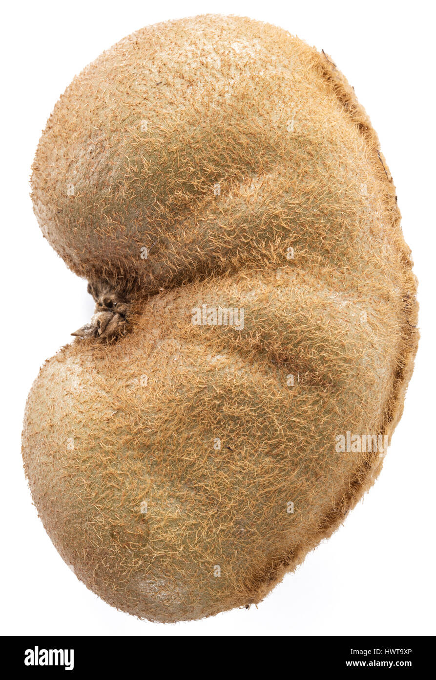 Kidney shape hi-res stock photography and images - Alamy