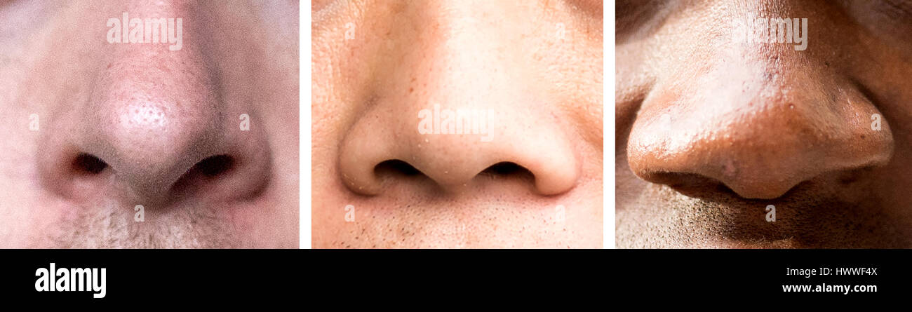 African Nose