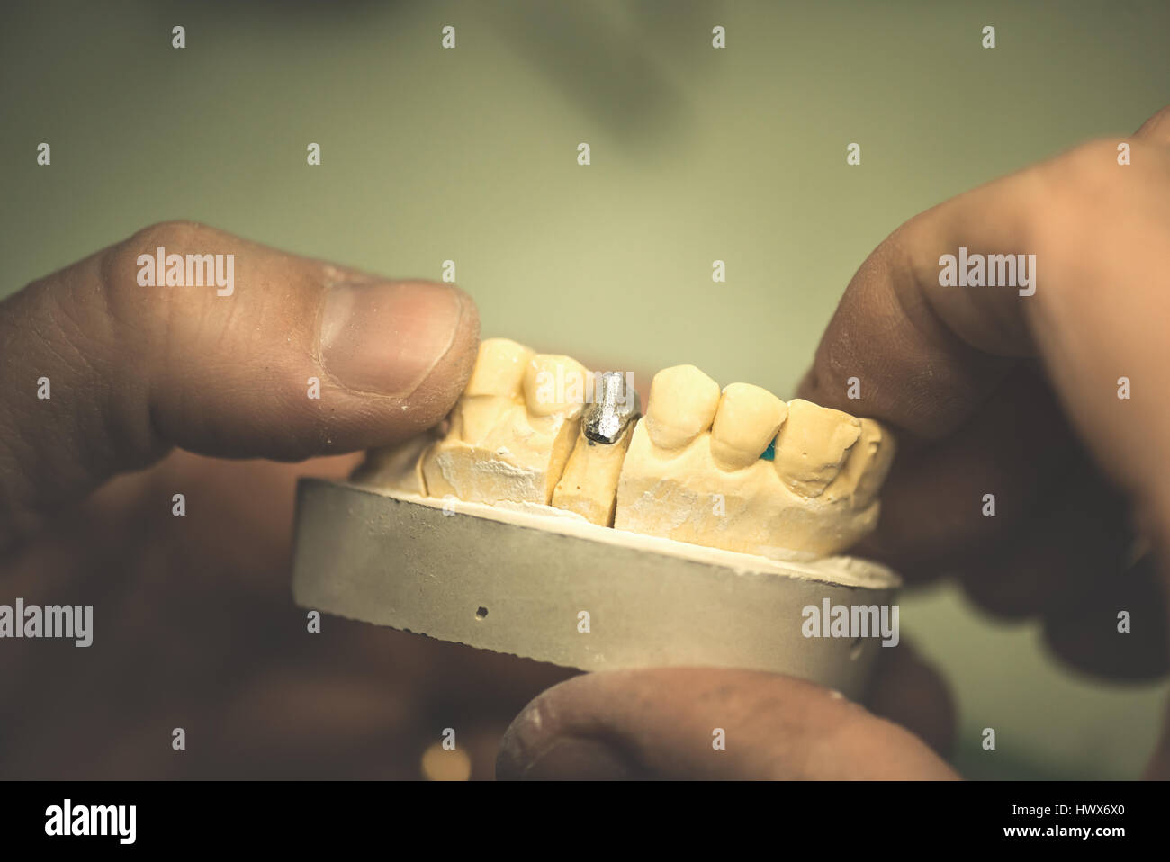 Dental prosthesis, artificial tooth, prosthetic, hands working on the ...