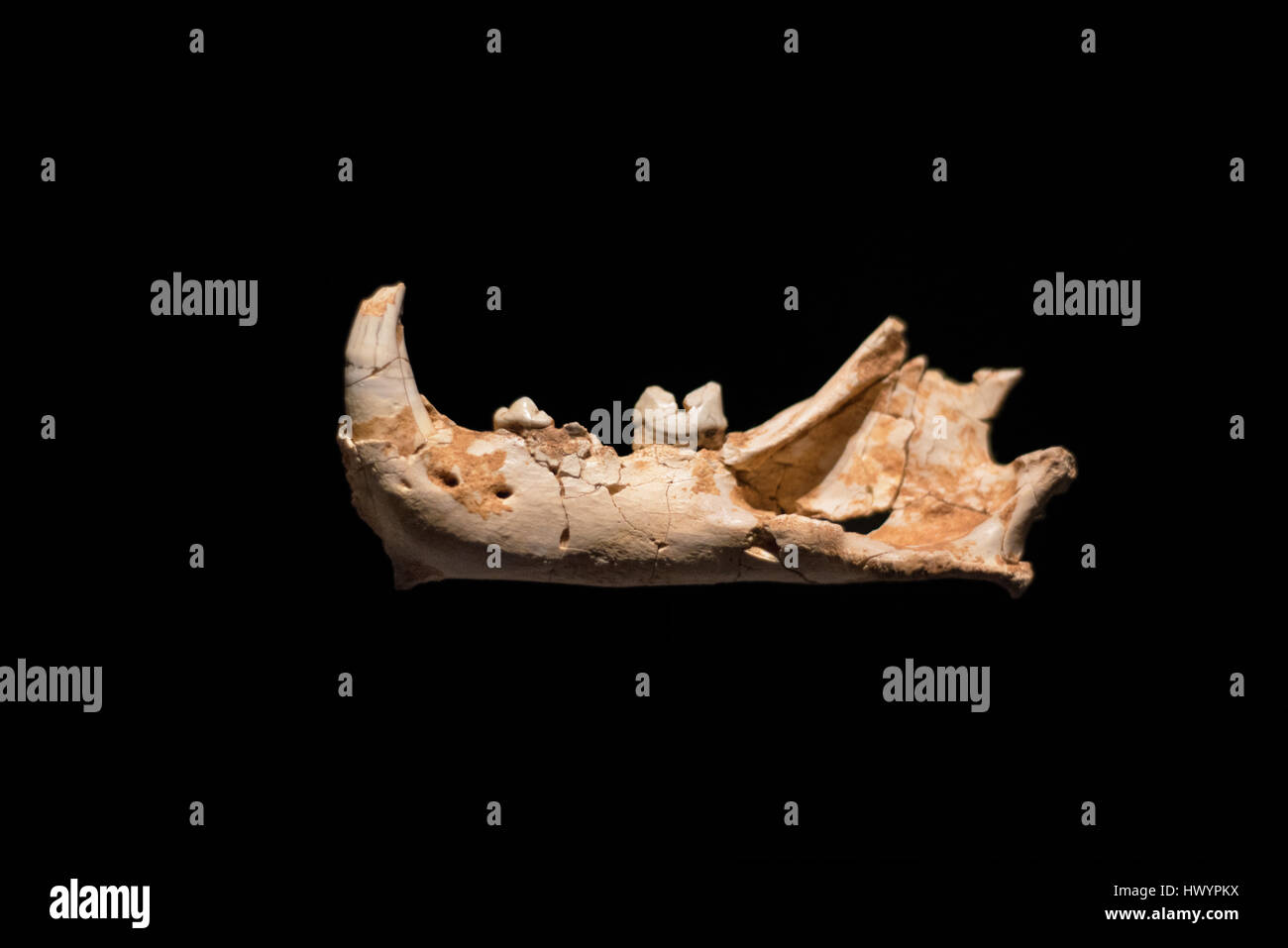 Maxilla mandible hi-res stock photography and images - Alamy