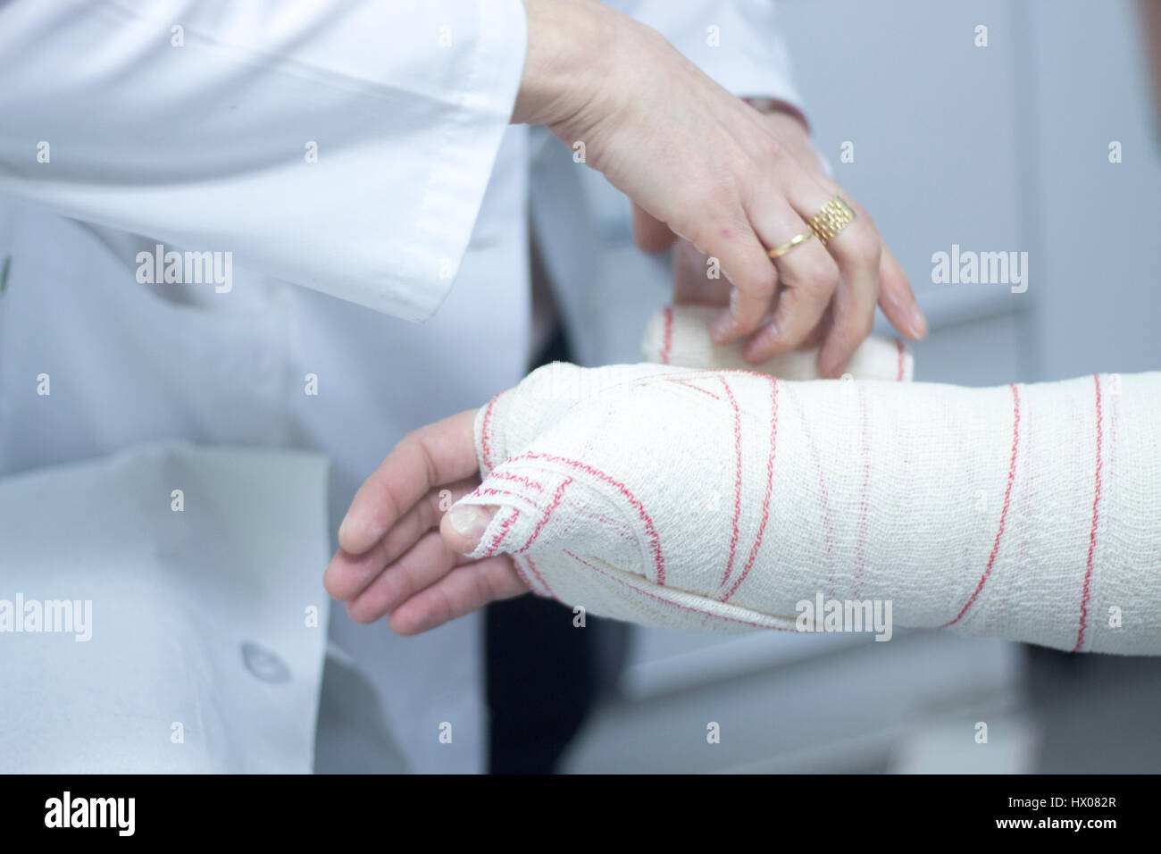 Doctor applying a plaster cast and bandages to patient forearm and ...