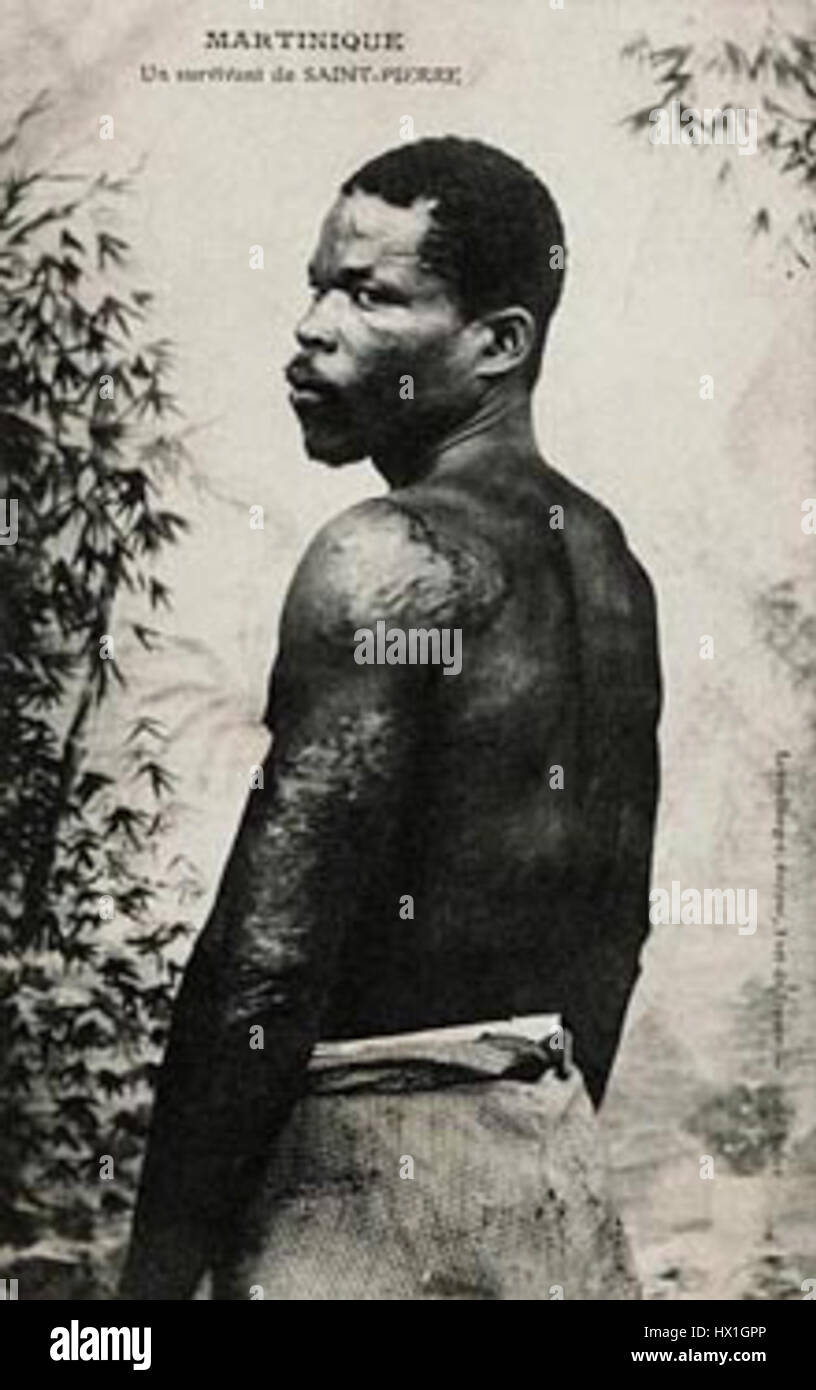 A depiction of Cyparis, a figure who became famous after surviving the ...