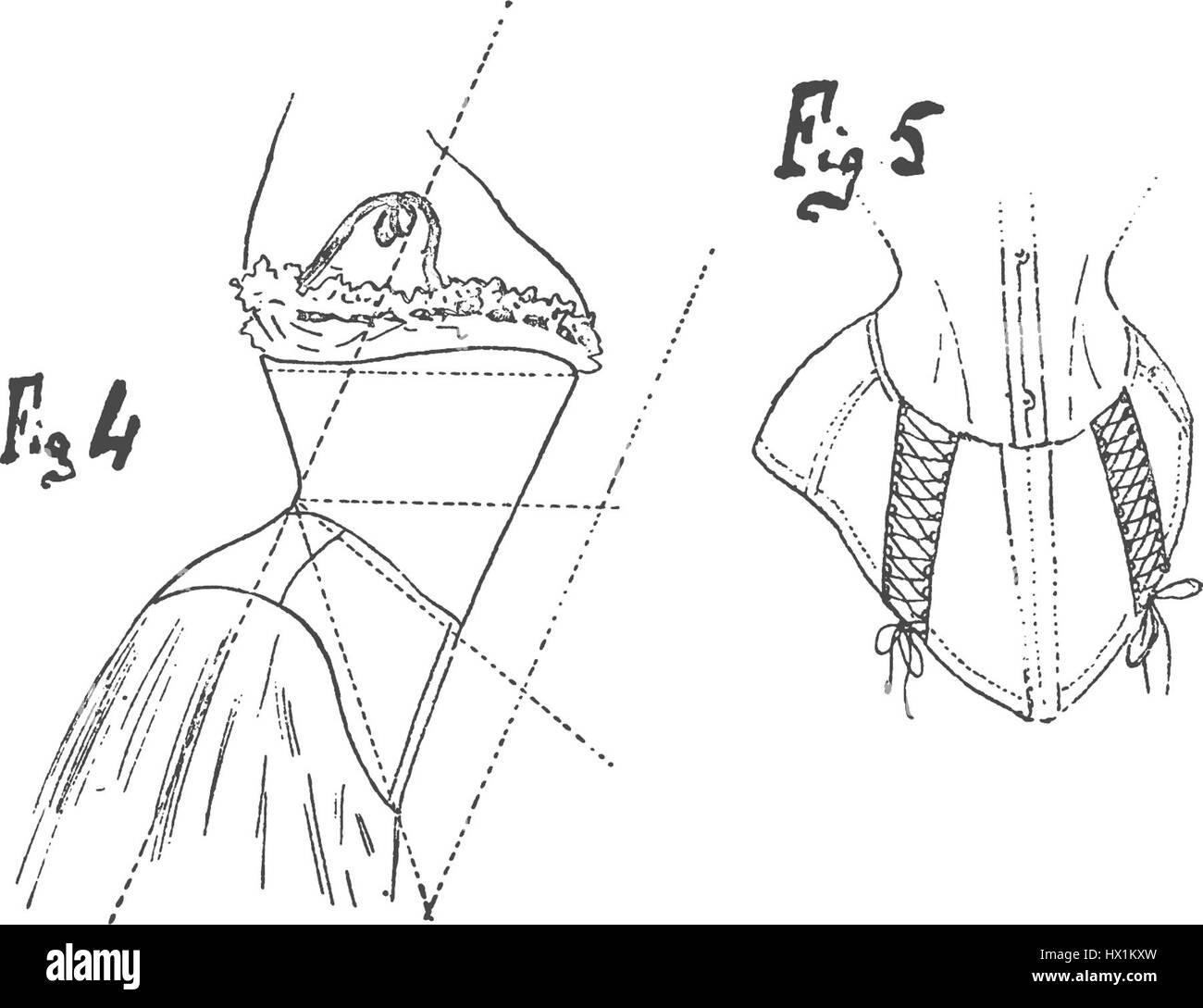 A 'corset à membrane abdominale' refers to a type of abdominal corset ...