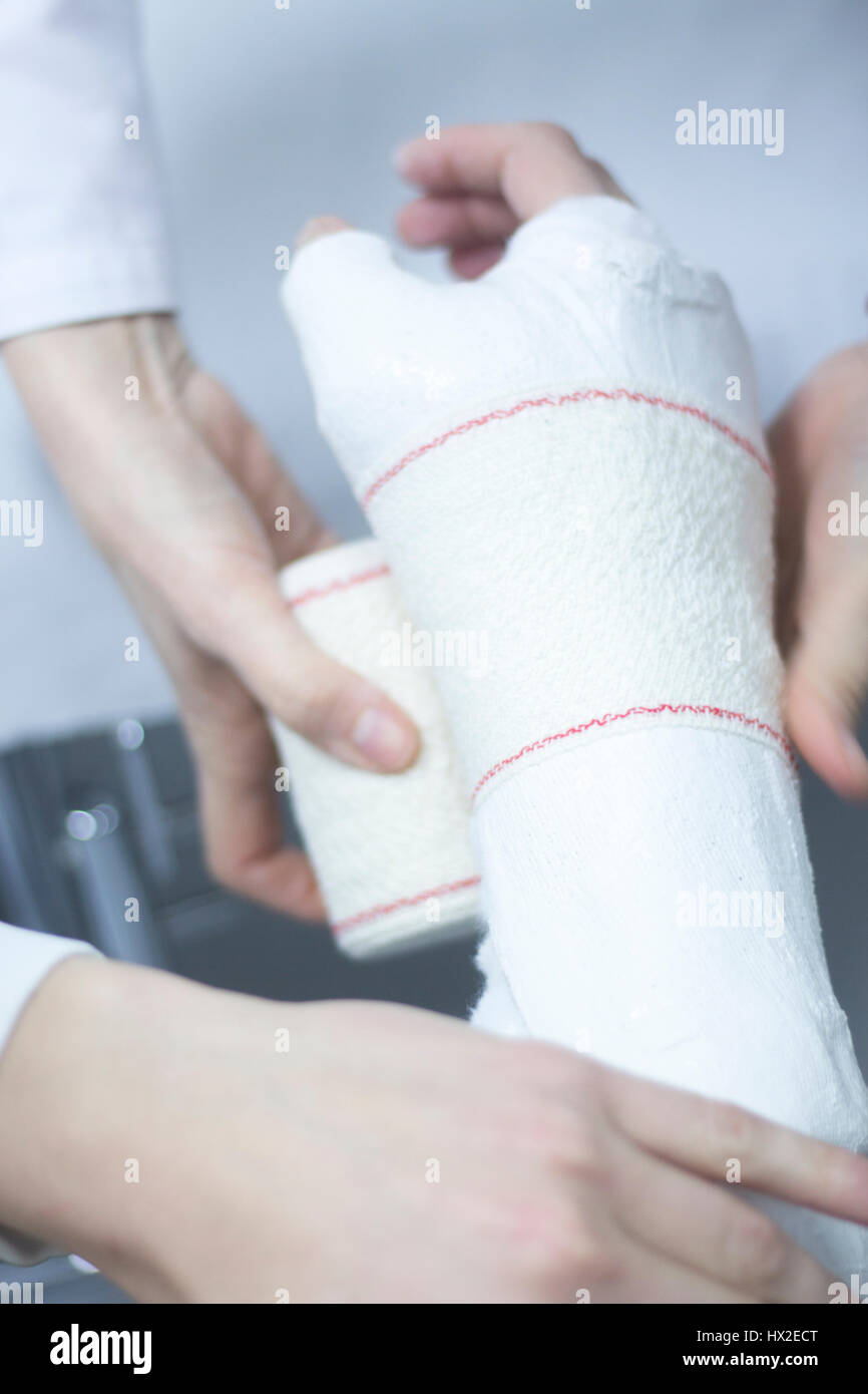 Doctor applying a plaster cast and bandages to patient forearm and ...