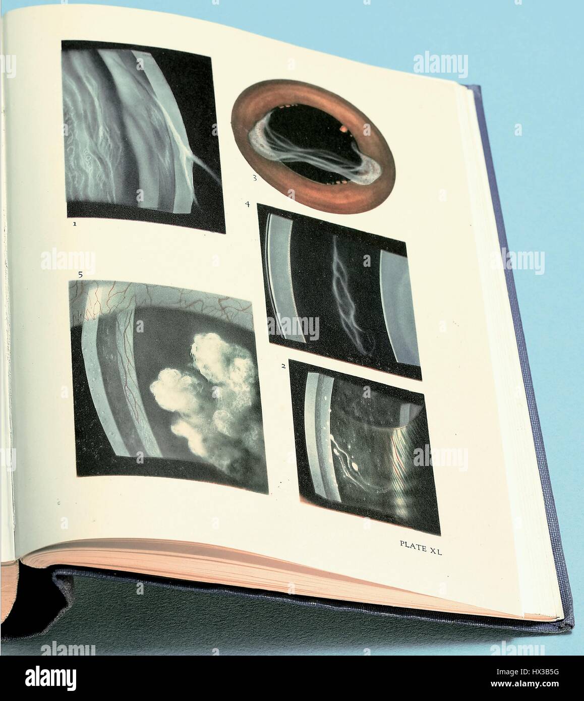 Biomicroscopy of the eye hi-res stock photography and images - Alamy