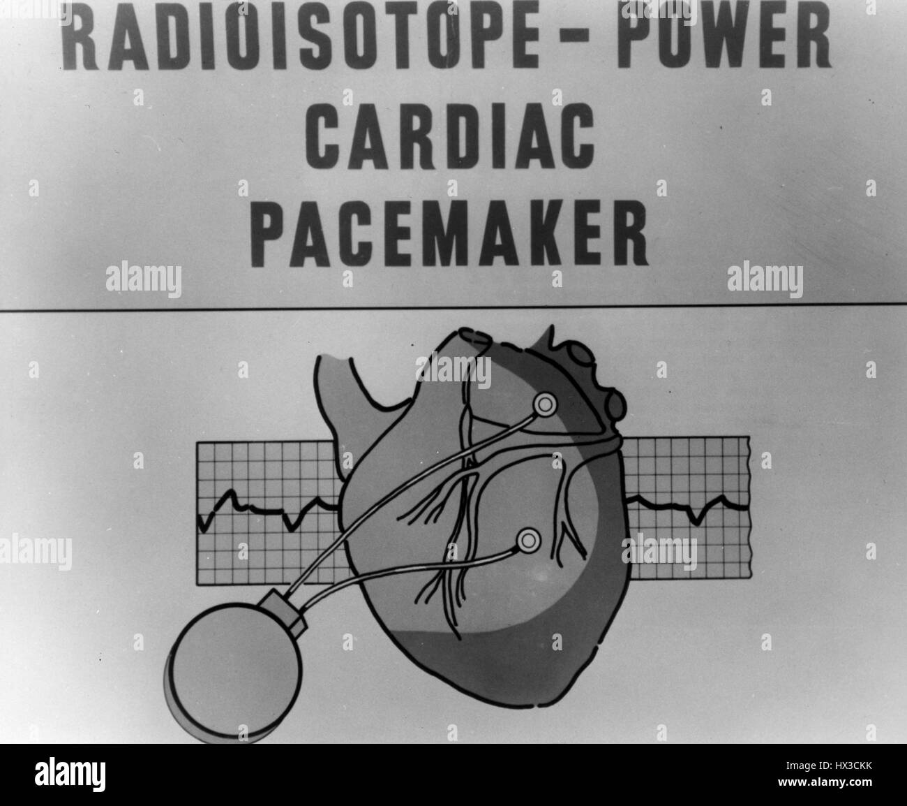 Nuclear powered pacemaker hi-res stock photography and images - Alamy