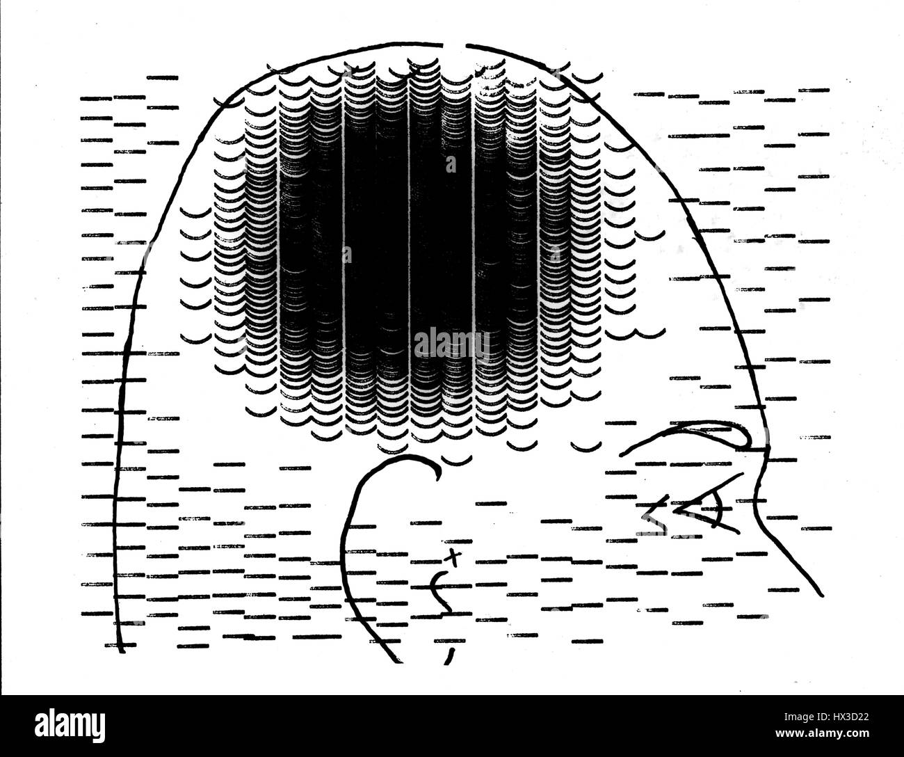 An illustration demonstrating a brain scan performed with a positron ...