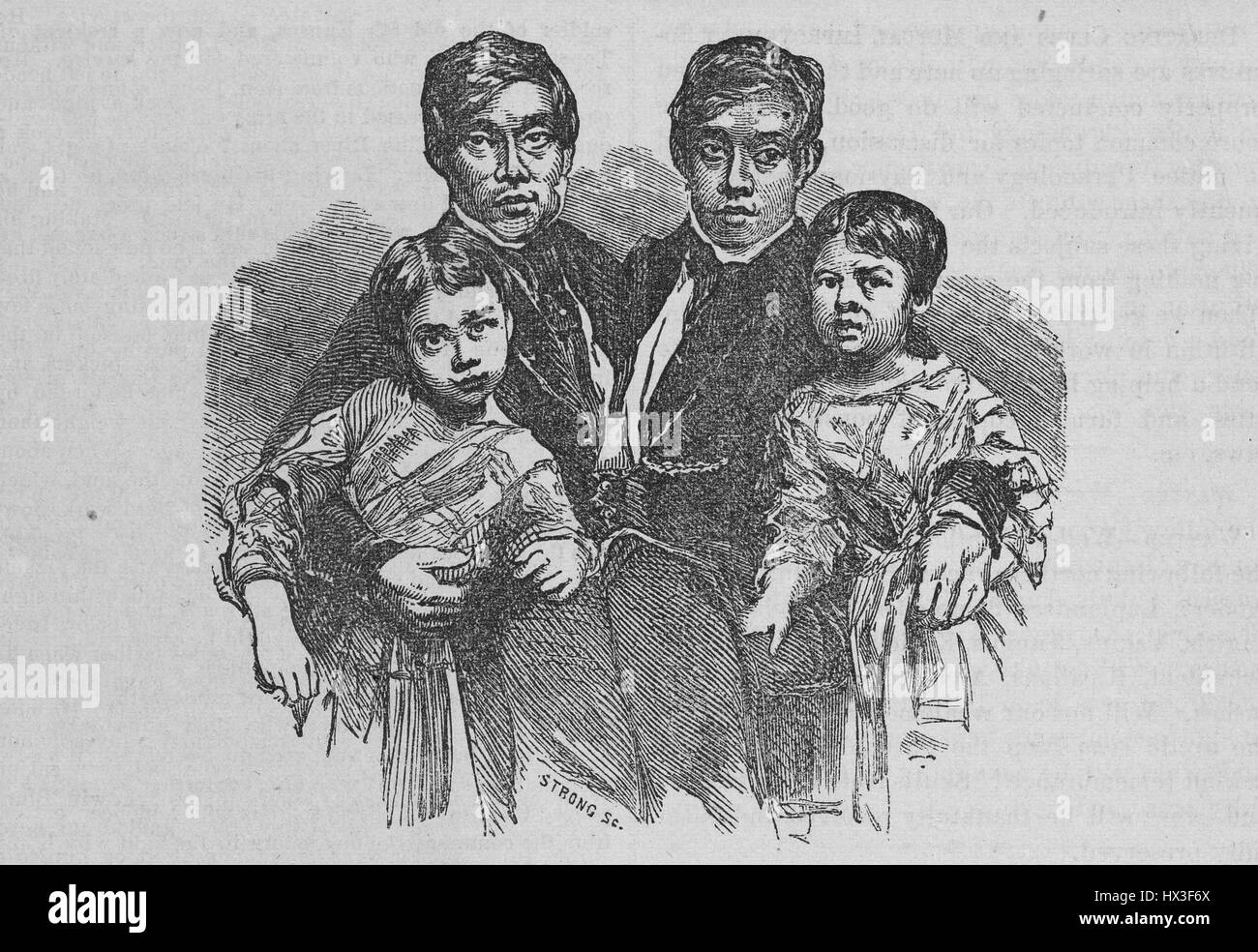 Chang And Eng Bunker