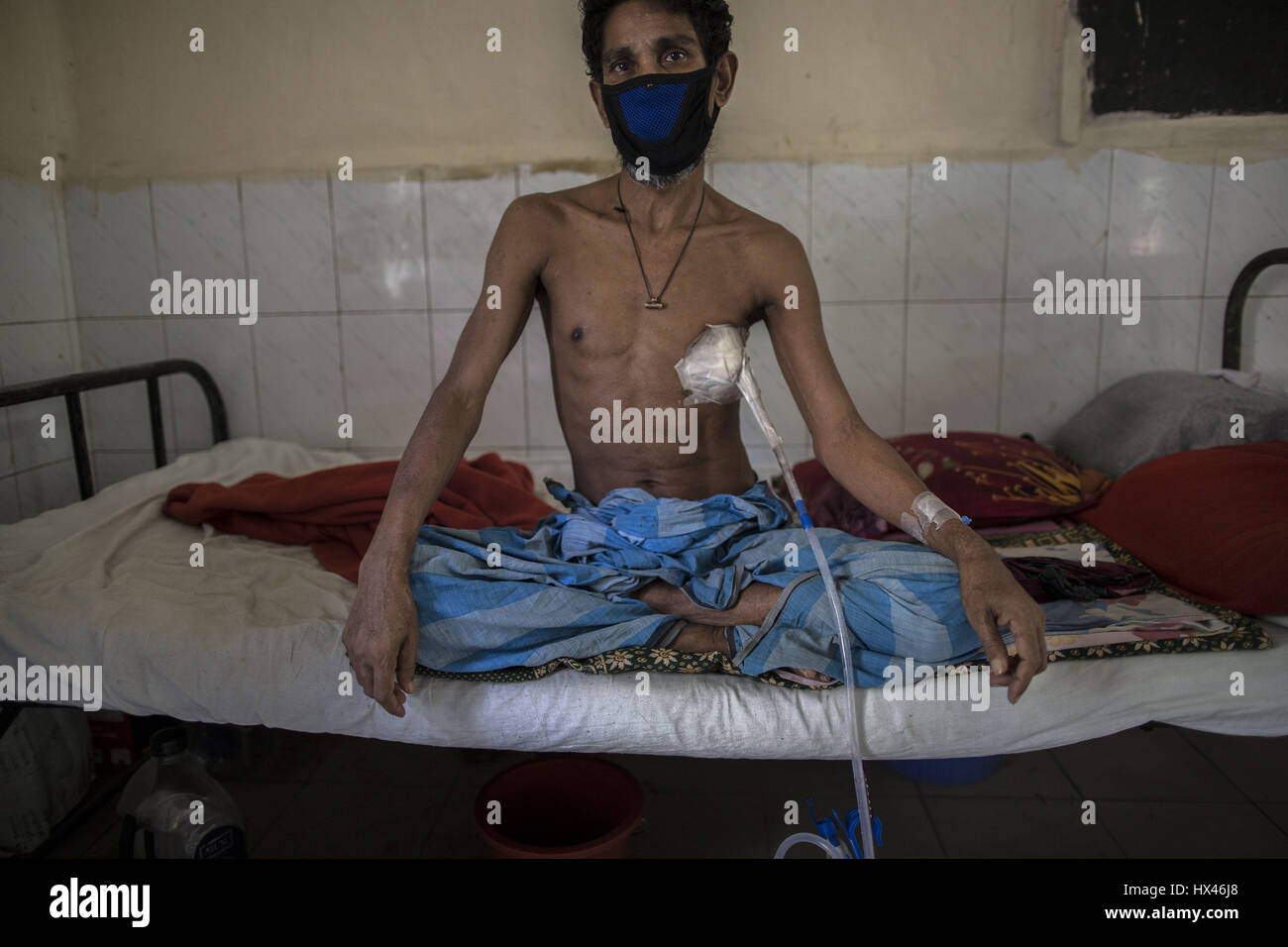 Chest drain hi-res stock photography and images - Alamy