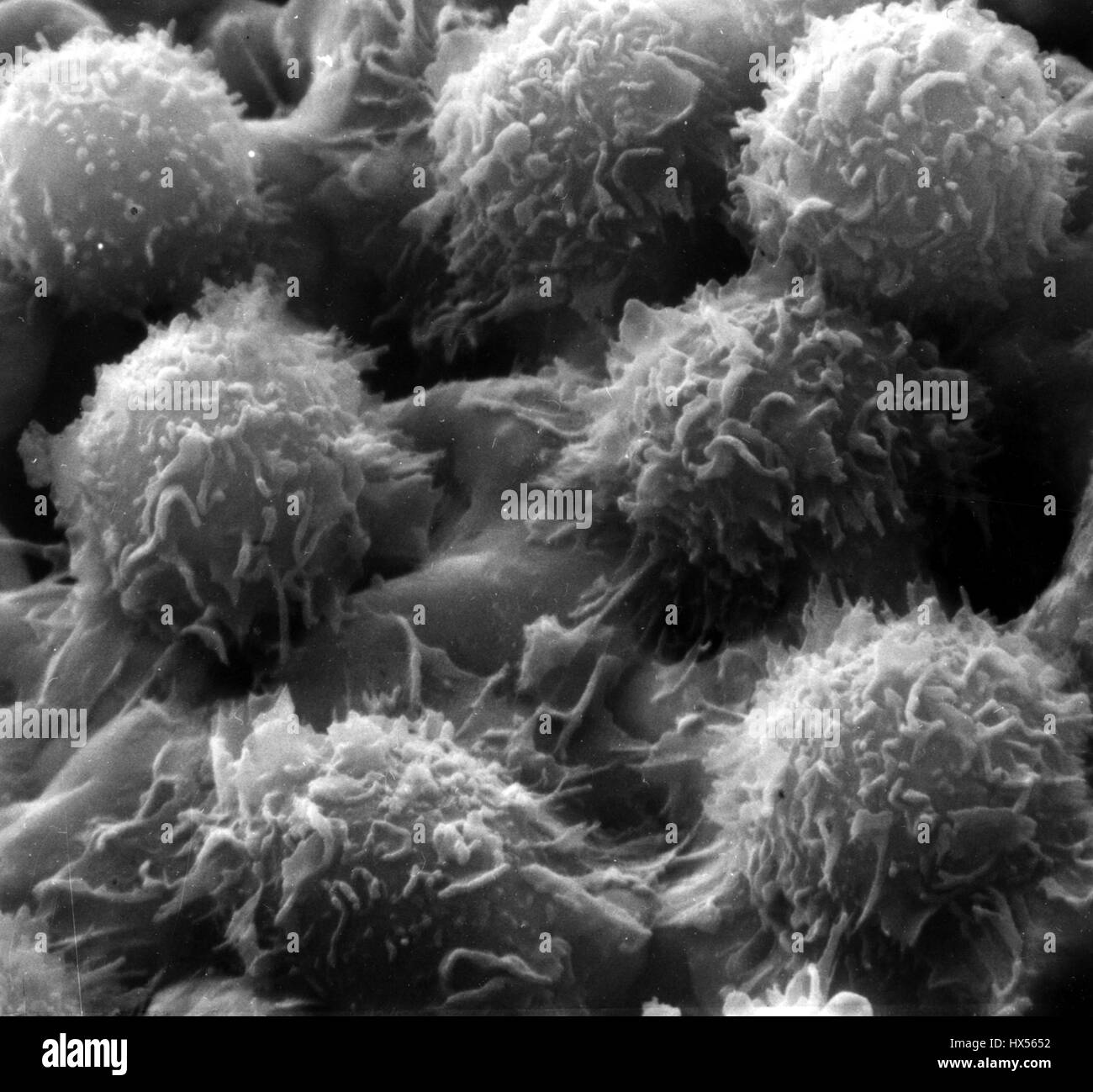 Electron Micrograph Stock Photos & Electron Micrograph Stock Images - Alamy