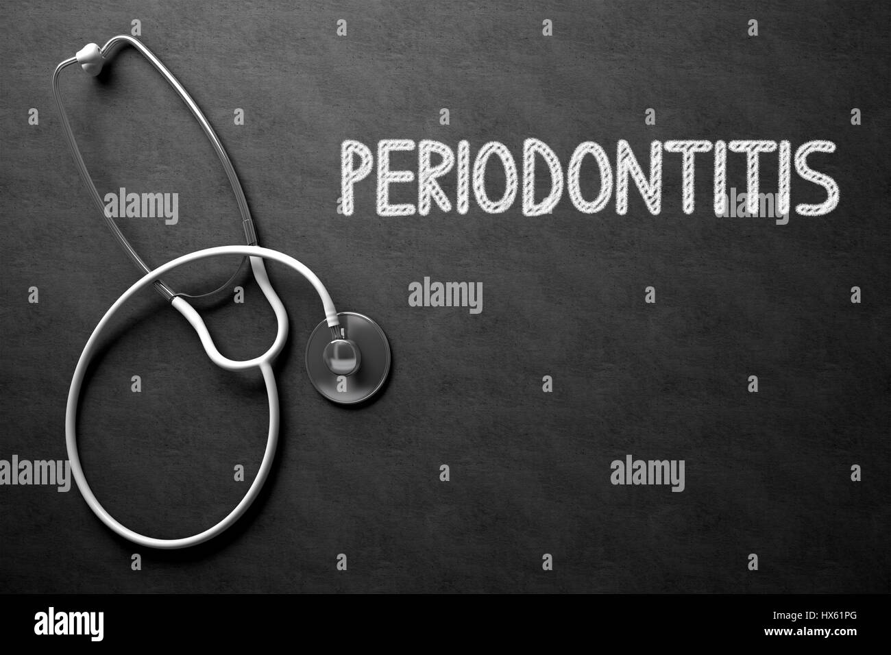 Periodontitis Concept on Chalkboard. 3D Illustration Stock Photo - Alamy