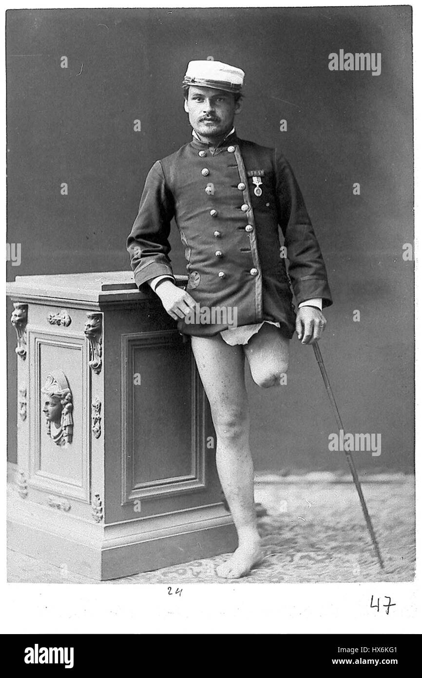 'Mutilado en la GdP 2' is a photograph or artwork depicting a wounded ...