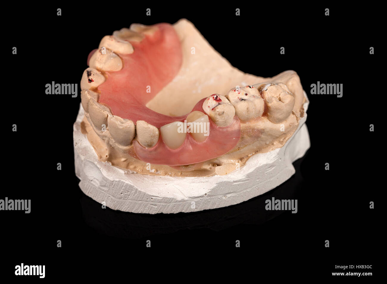 Dentures on plaster cast. Close-up on a black background Stock Photo ...