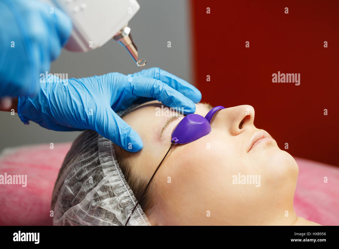 Laser removal of tattoo eyebrows. Shooting closeups. Cosmetic medical ...