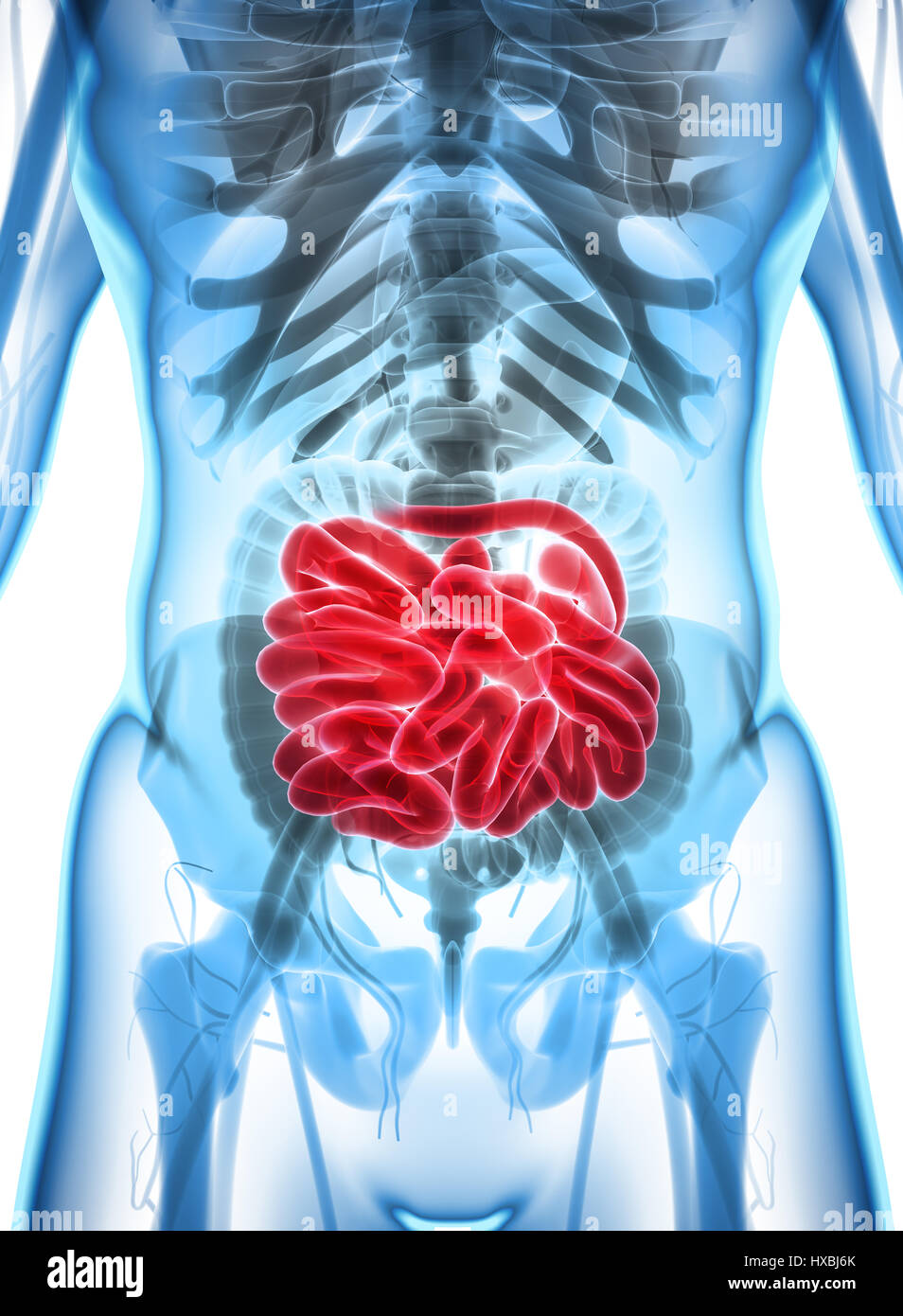 Inflamed intestines hi-res stock photography and images - Alamy